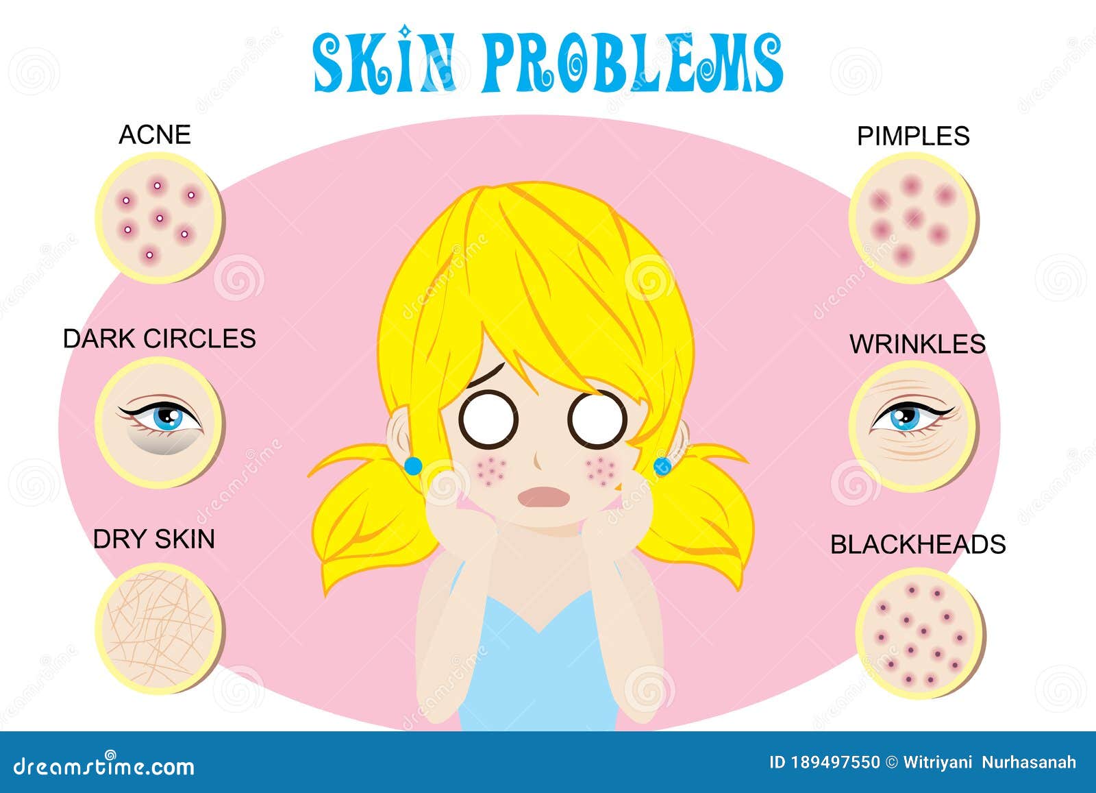 6 Common Skin Problems on Face Stock Vector - Illustration of child ...