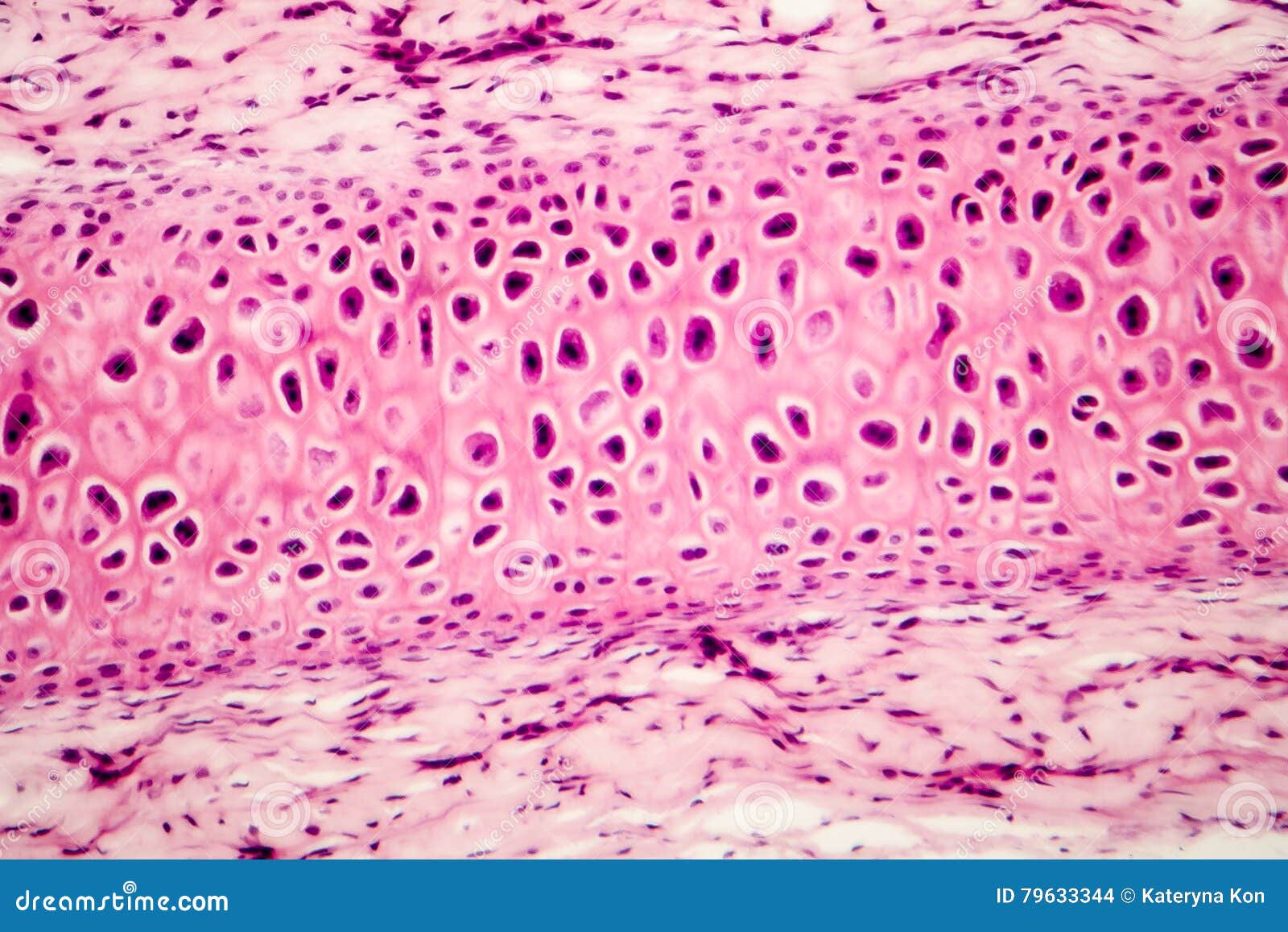 Compact bone micrograph stock photo. Image of histological - 79633344