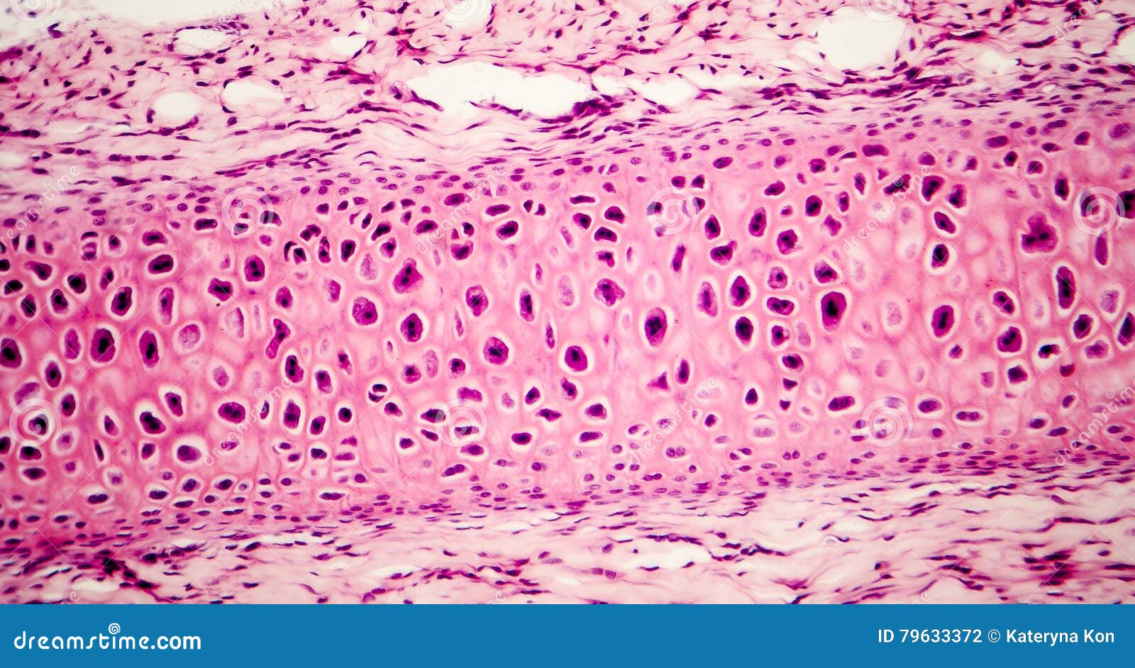 Compact bone micrograph stock photo. Image of system - 79633372
