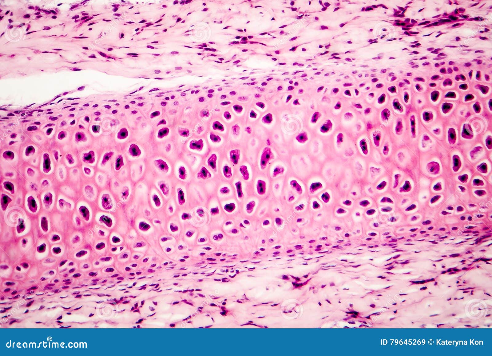 Compact bone micrograph stock image. Image of microscope - 79645269