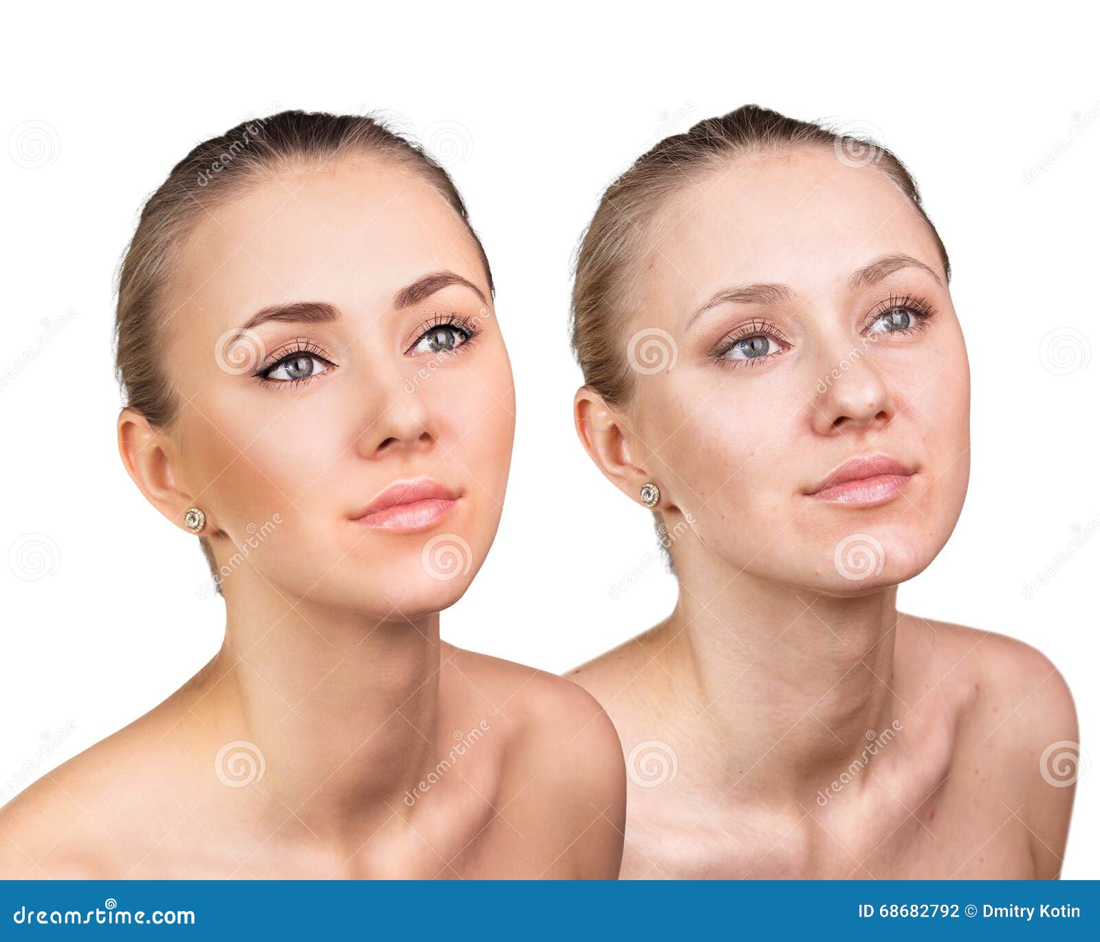 Comparative Portrait Of Female Face, Before And After Plastic Surgery ...