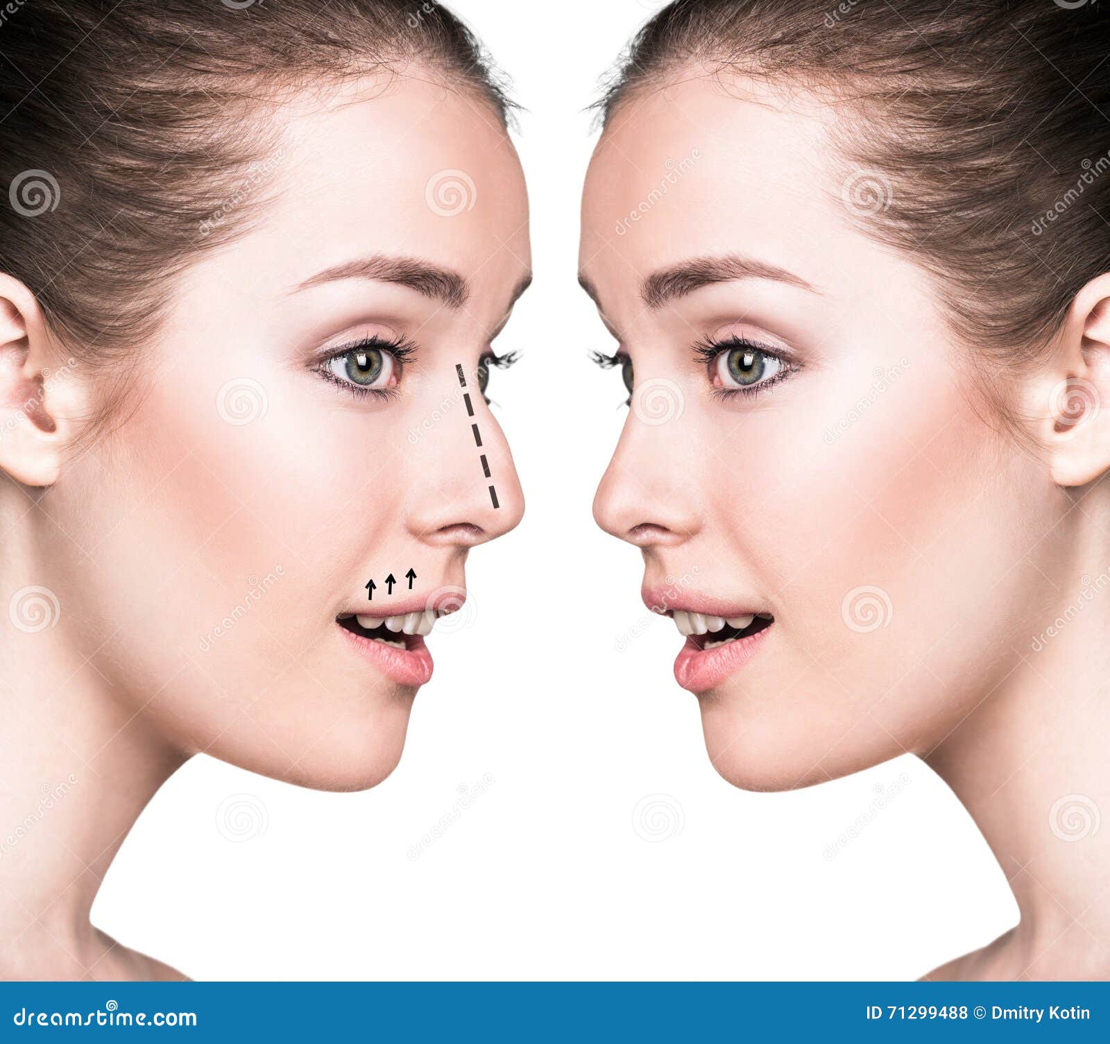 Comparative Portrait of Female Face Stock Photo - Image of correction ...