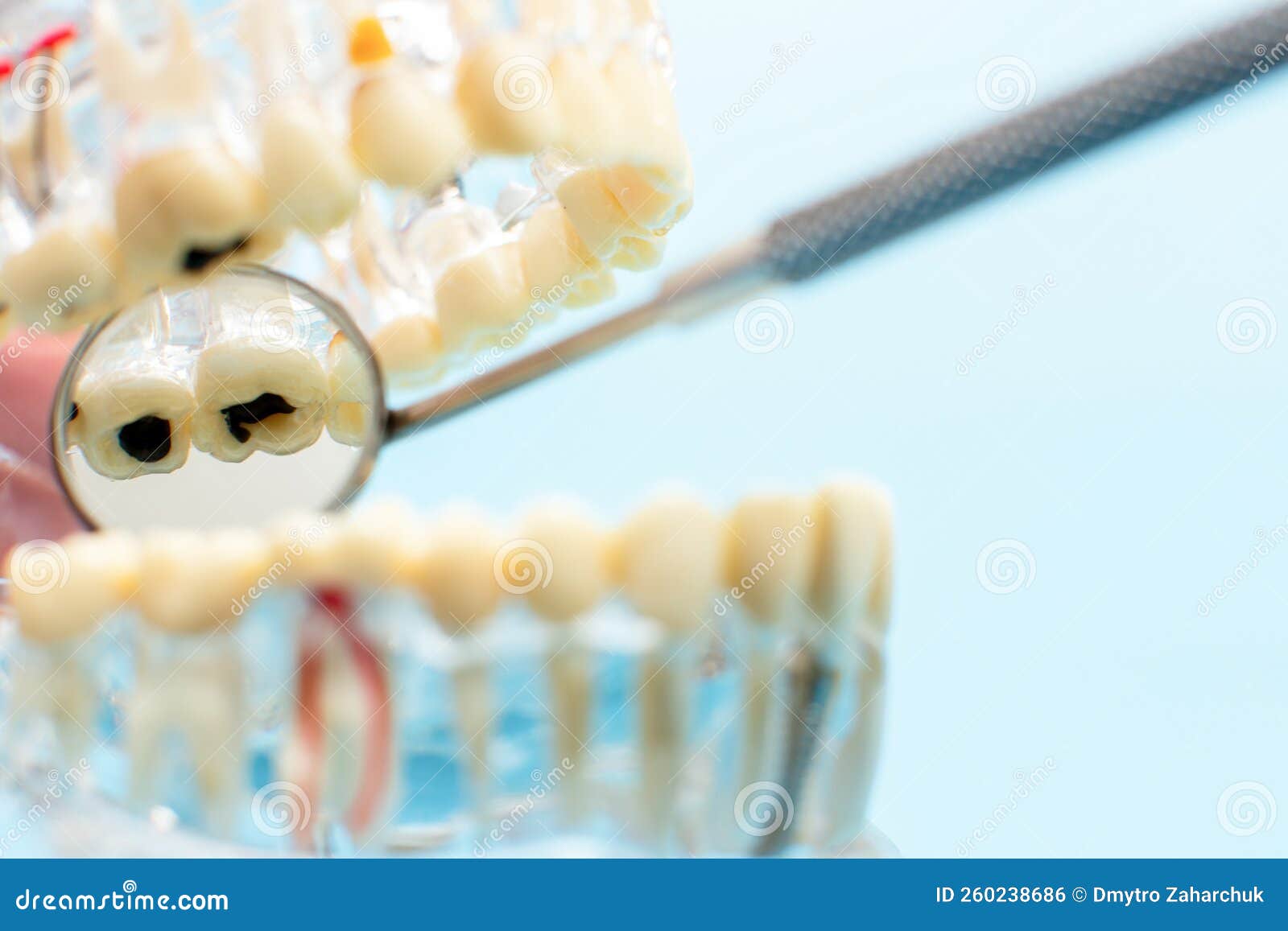 Compare Tooth Model and Tooth Model with Metal Wire Dental Stock Photo ...