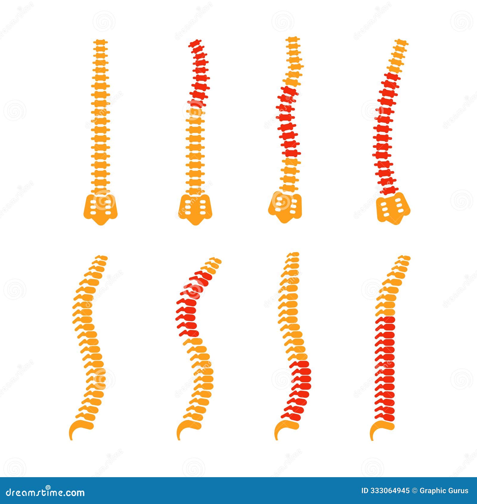 Comparing Different Human Spine Shapes with Correct and Incorrect ...