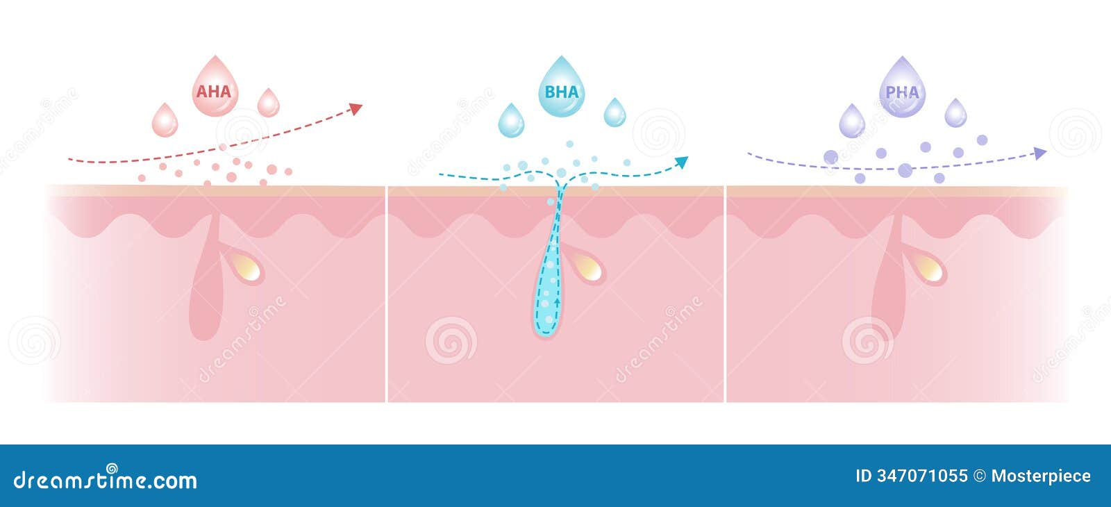 Comparison of Alpha, Beta, Poly Hydroxy Acids Characteristics ...
