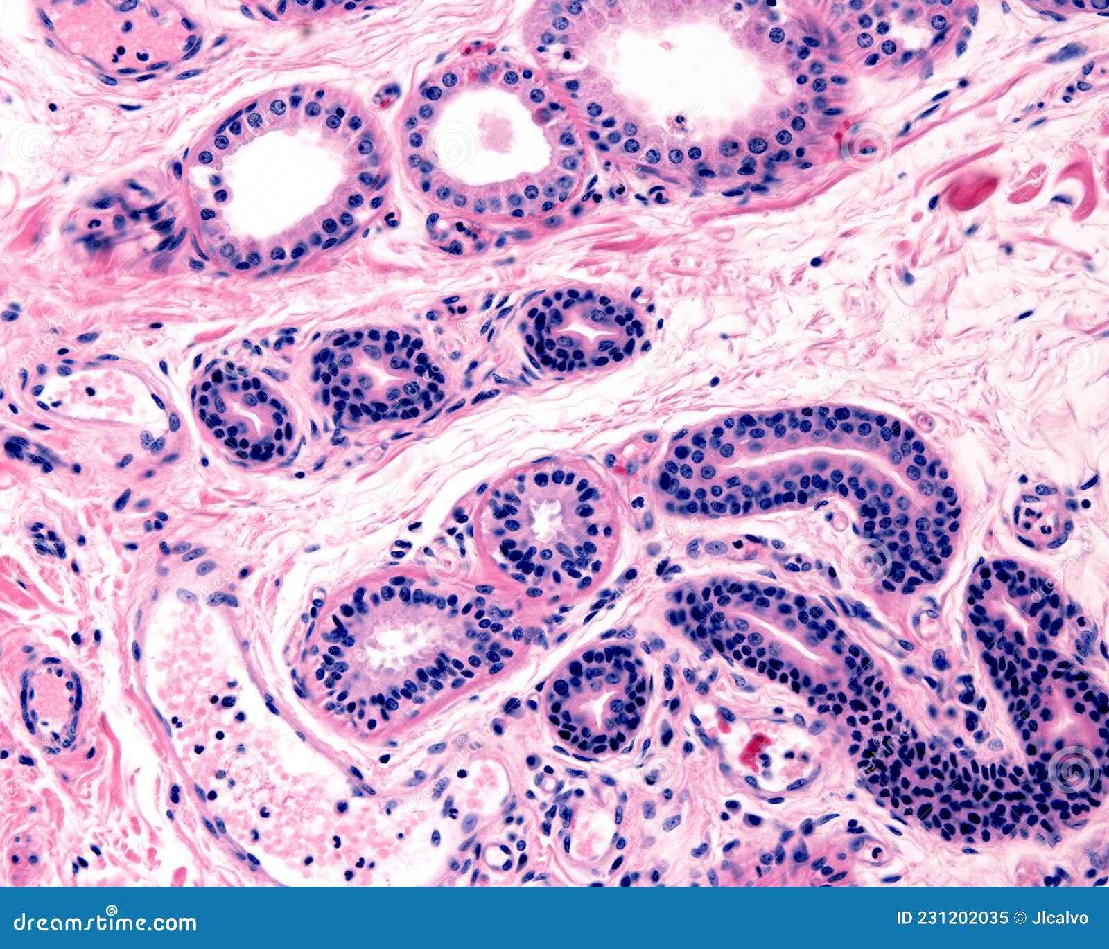 Comparison between Eccrine and Apocrine Sweat Glands Stock Image ...