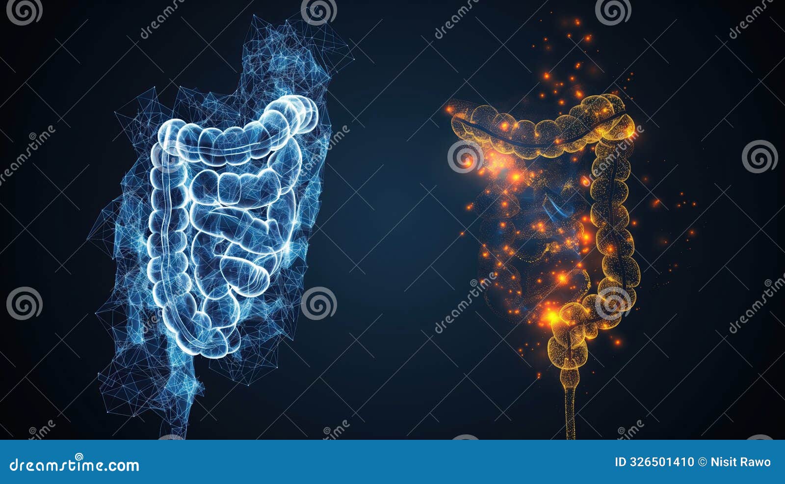 Comparison of Healthy and Inflamed Intestines with Visual Effects Stock ...
