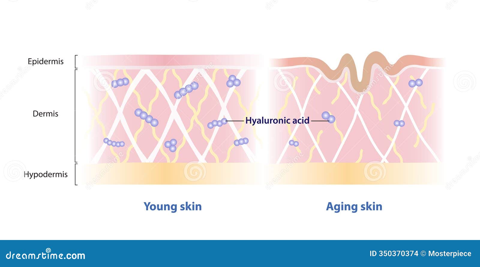 Dermis Vector Icon In 6 Different Modern Styles. Black, Two Colored Dermis Icons Designed In ...