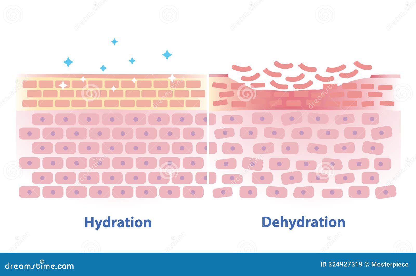 Comparison of Hydration and Dehydration Skin Vector Illustration. Stock ...