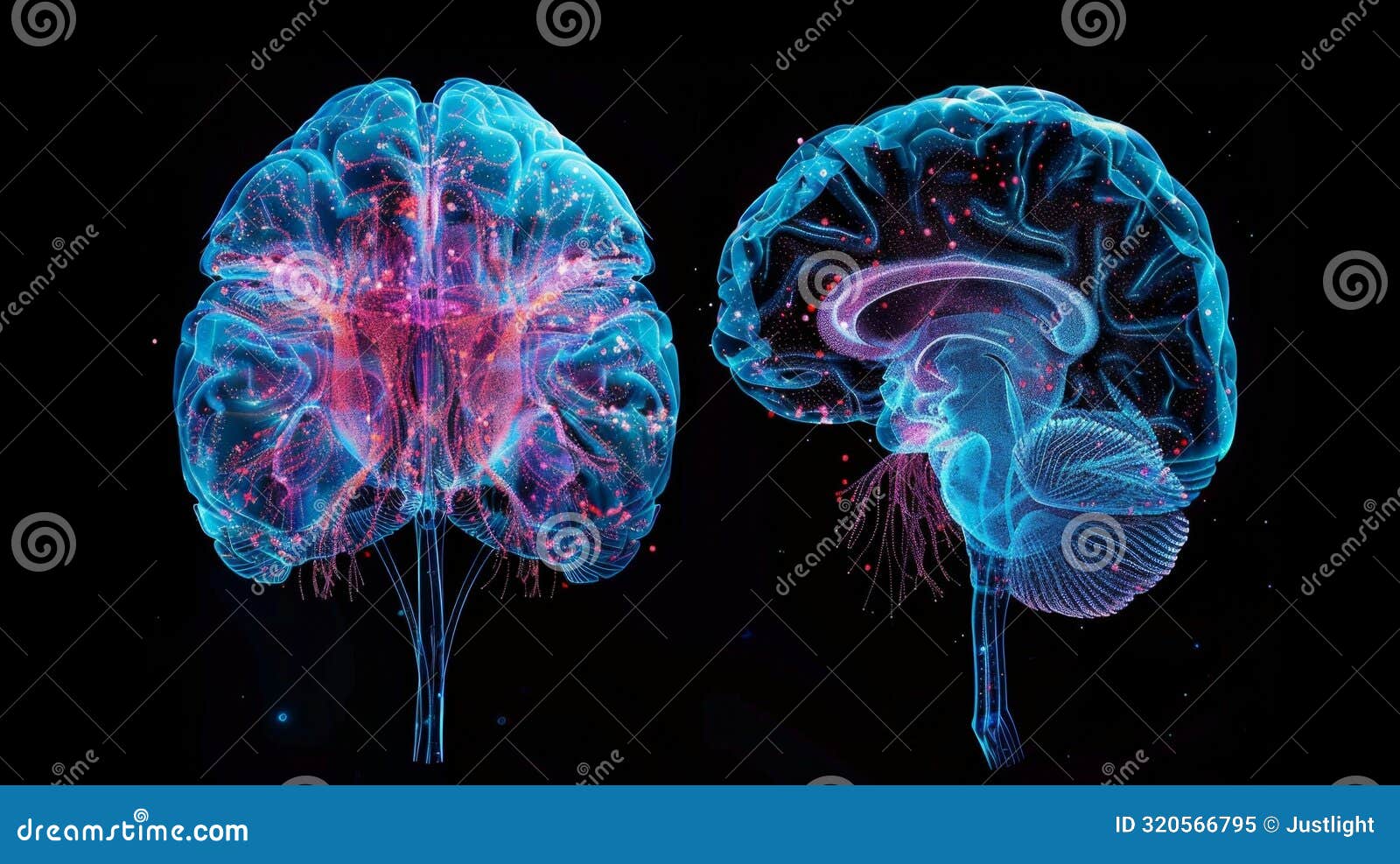 A Comparison between a Normal Brain and a Brain with Reduced Levels of ...