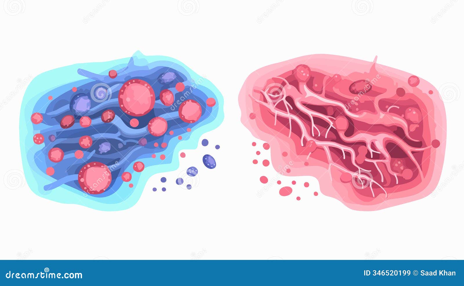 Comparison of Normal and Sick Gastrointestinal Stock Illustration ...