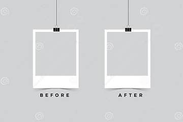 Comparison before and after Photo Frame Blue Gradient Background Stock ...