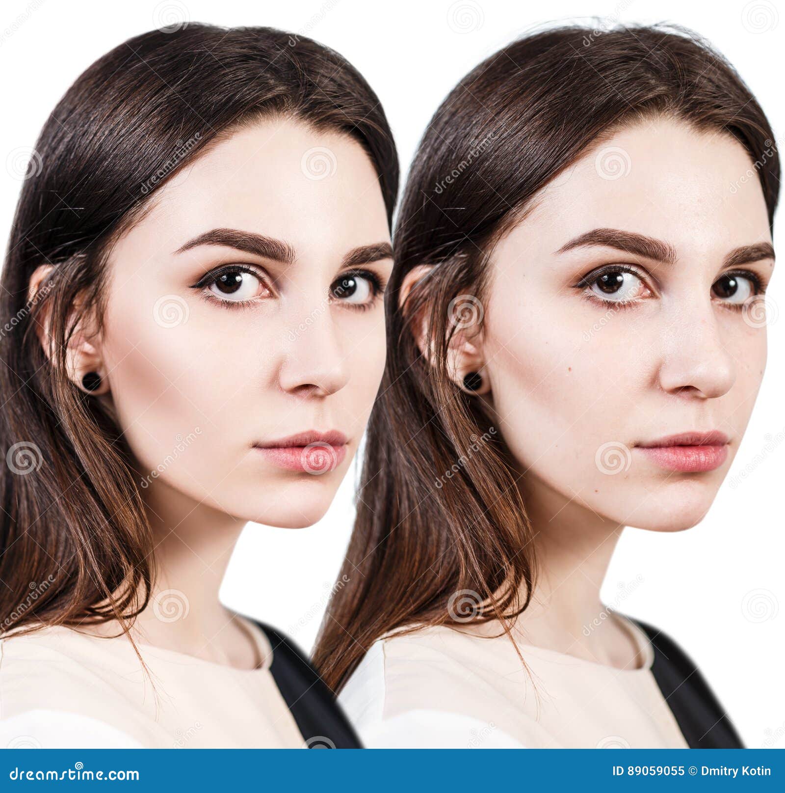 Comparison Portrait of Young Woman Stock Image - Image of acne, closeup ...