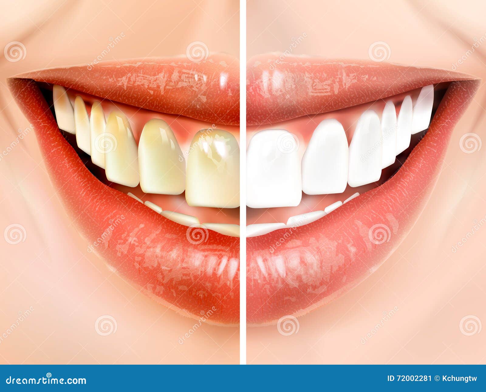Comparison of teeth stock vector. Illustration of oral - 72002281