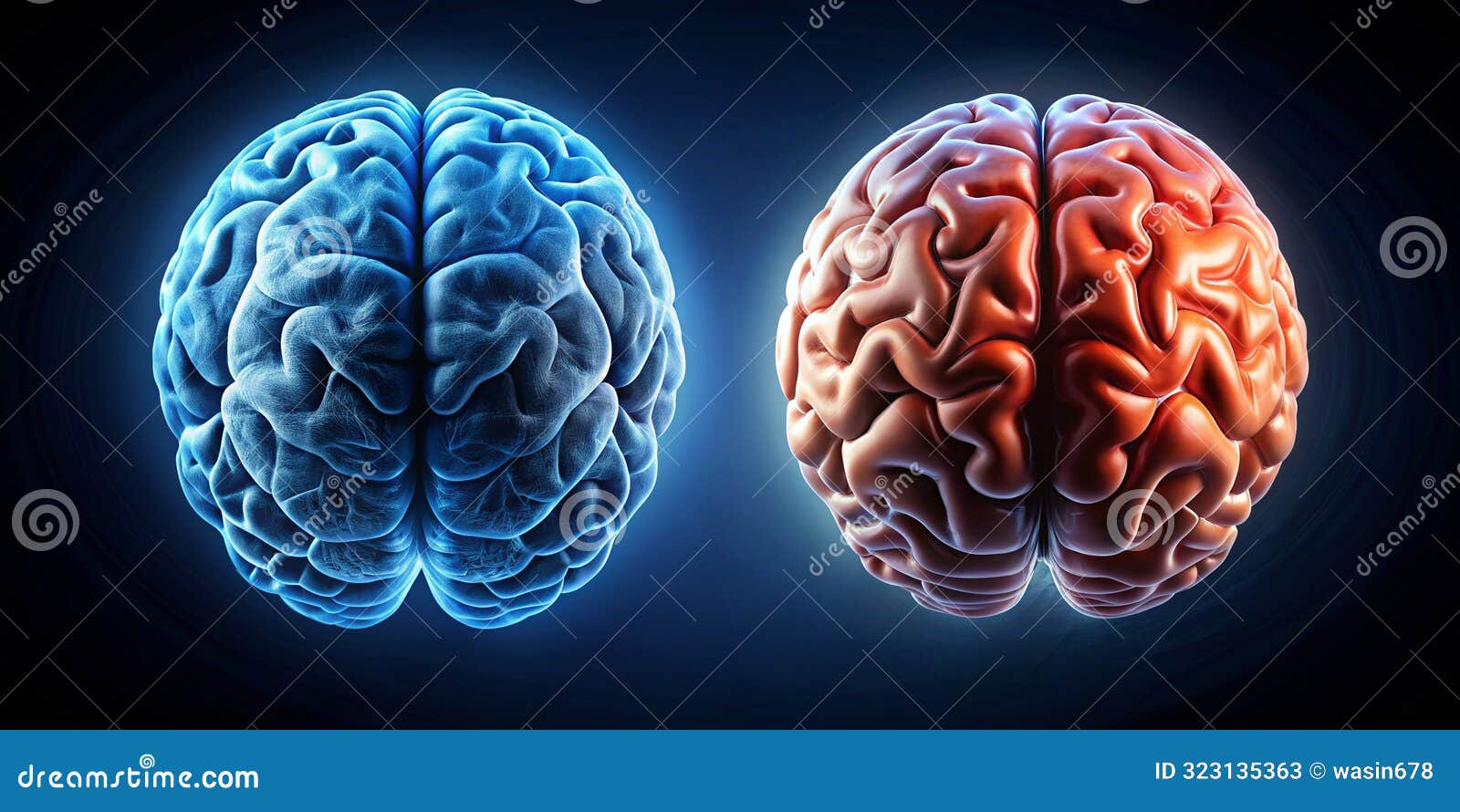 A Comparison of Two Brains One Normal and One with a Neurological ...