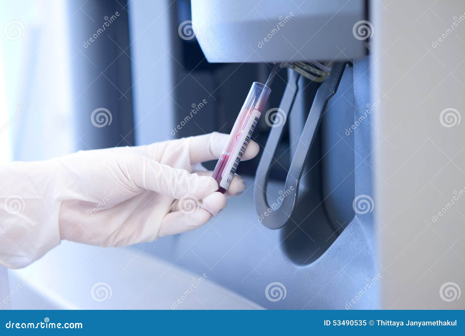 Complete Blood Count (CBC) Machine Stock Image - Image of consulting ...