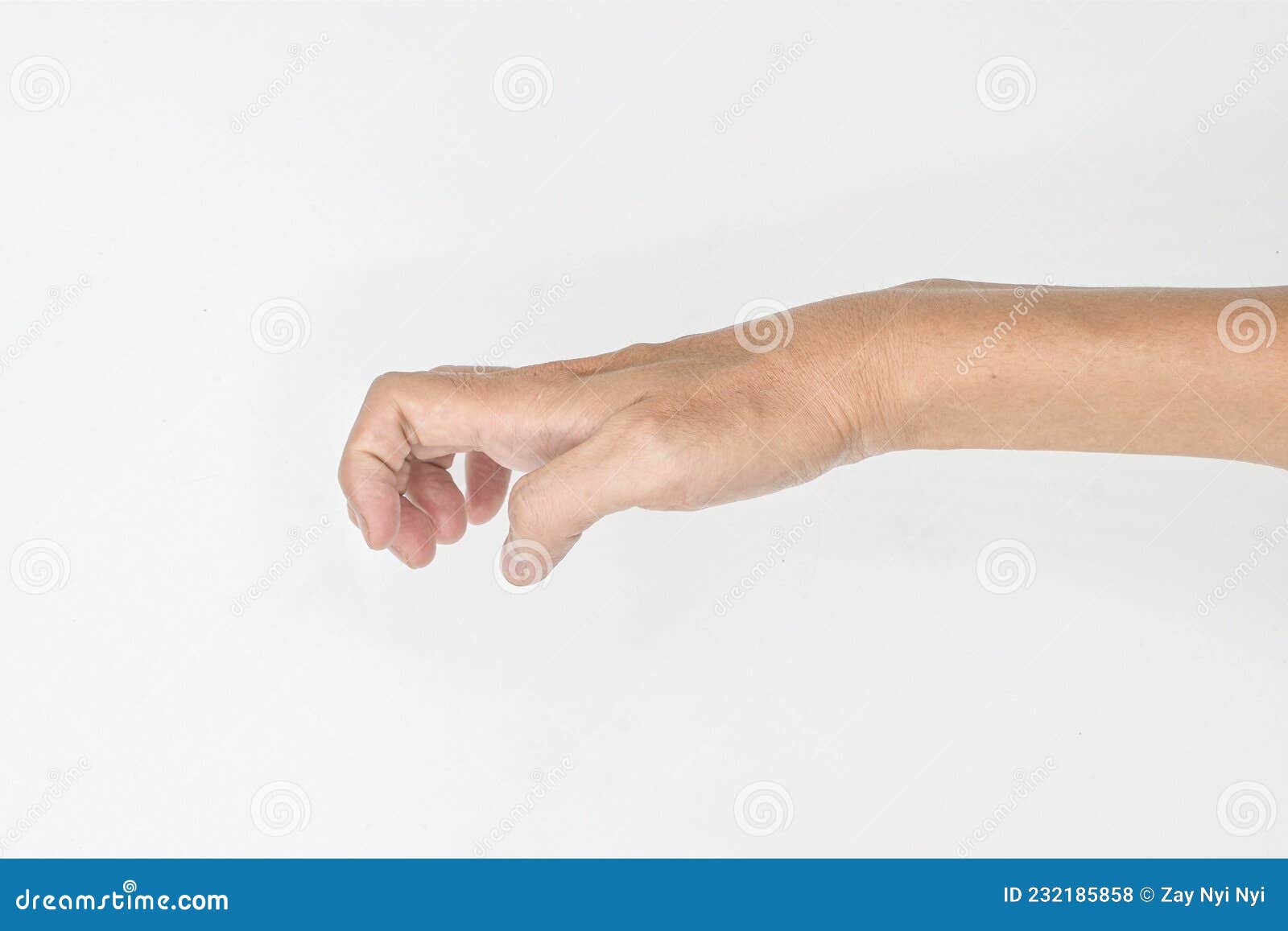 Complete Claw Hand Abnormality Stock Photo - Image of fingers, abnormal ...
