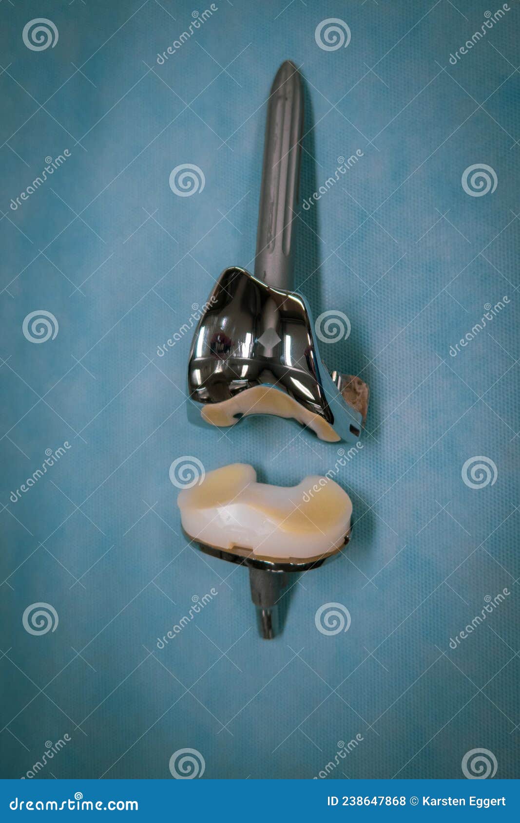 Complete Explanted Knee Prosthesis Consisting of Distal and Proximal ...