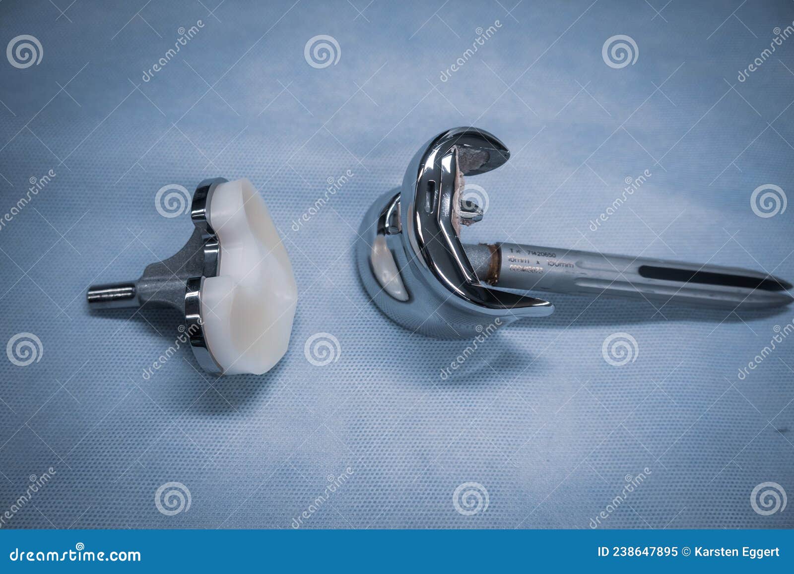 Complete Explanted Knee Prosthesis Consisting Of Distal And Proximal ...