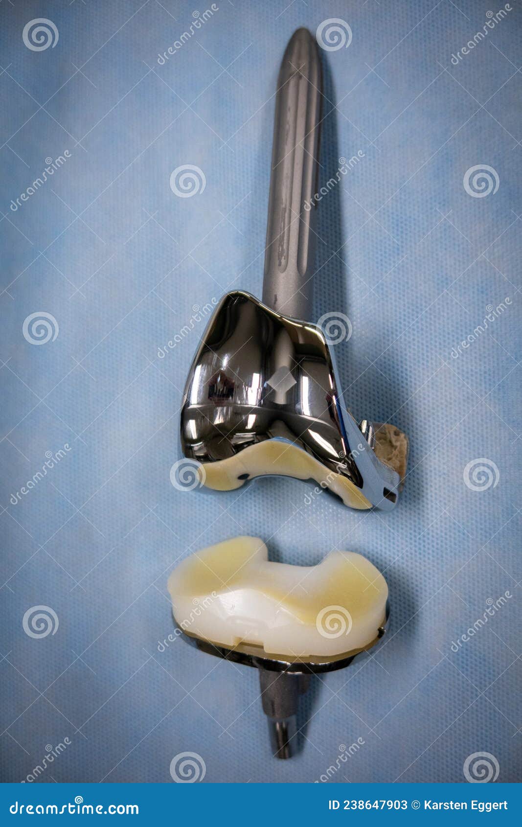 Complete Explanted Knee Prosthesis Consisting Of Distal And Proximal ...