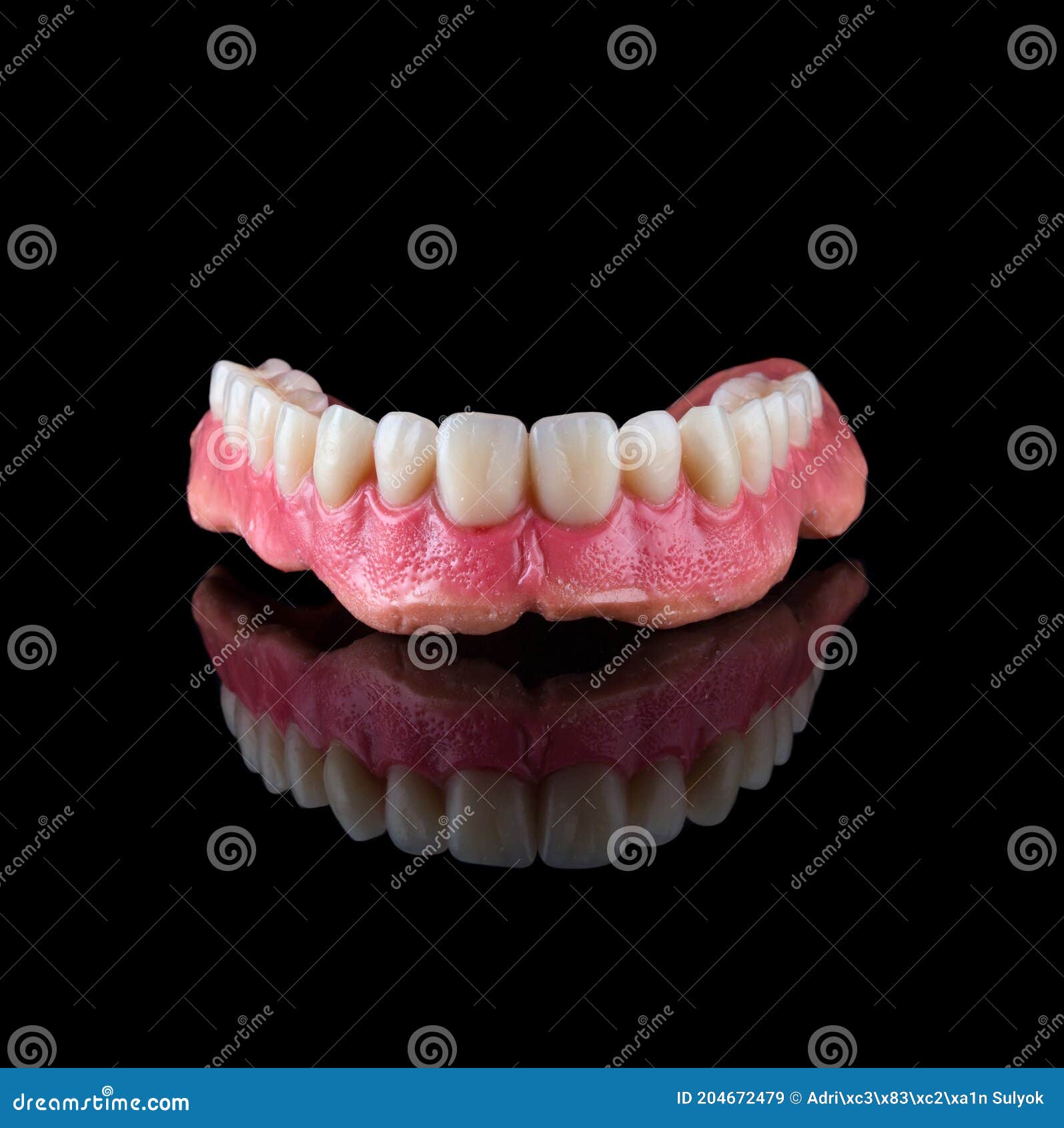 Complete Maxillary Denture â€“ Wax-Up and Gingival Contouring Stock ...