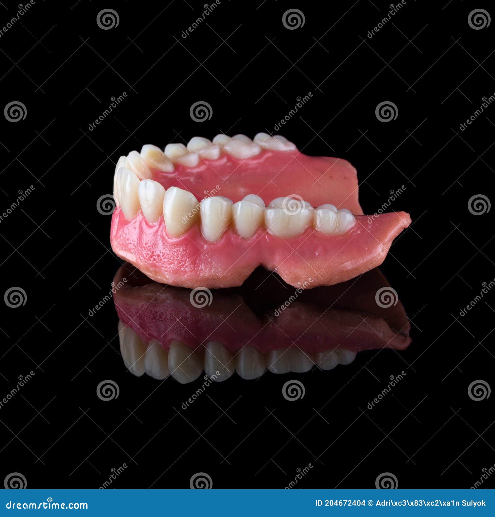Complete Maxillary Denture â€“ Wax-Up and Gingival Contouring Stock ...
