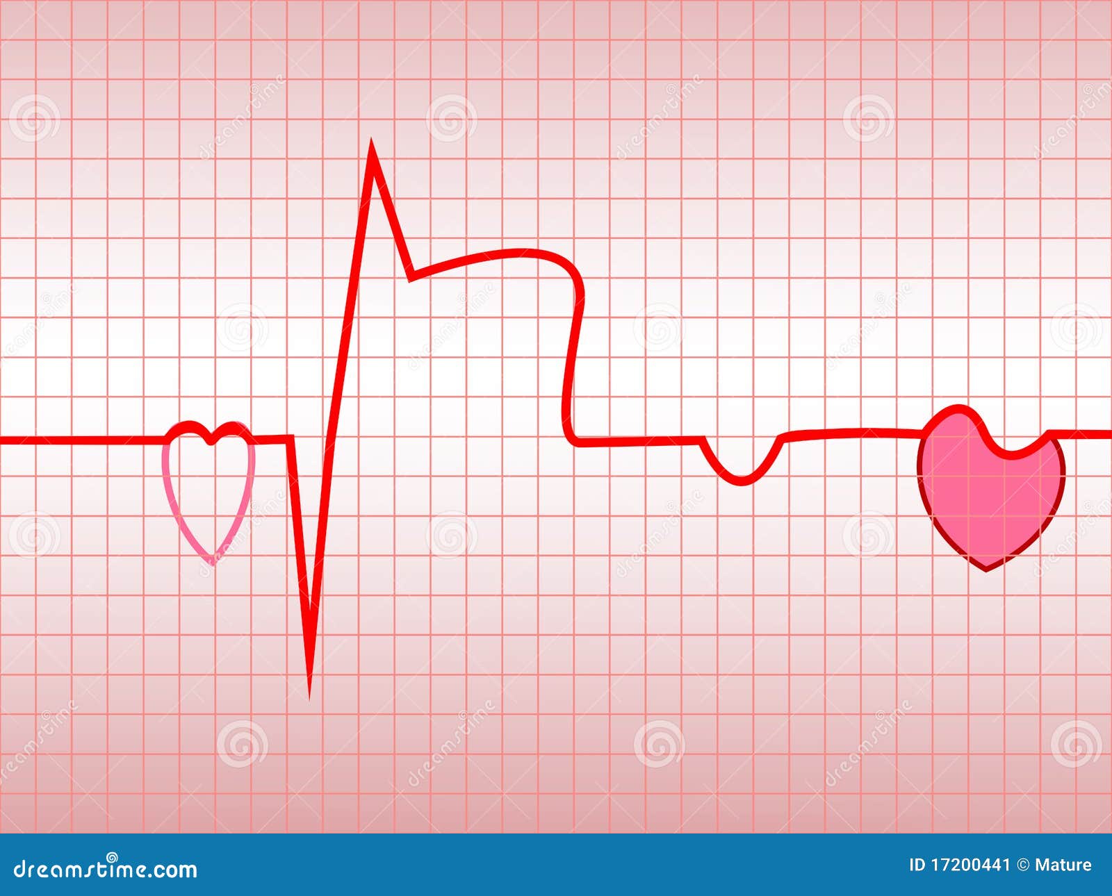 Complex Of ECG Cartoon Vector | CartoonDealer.com #17200441