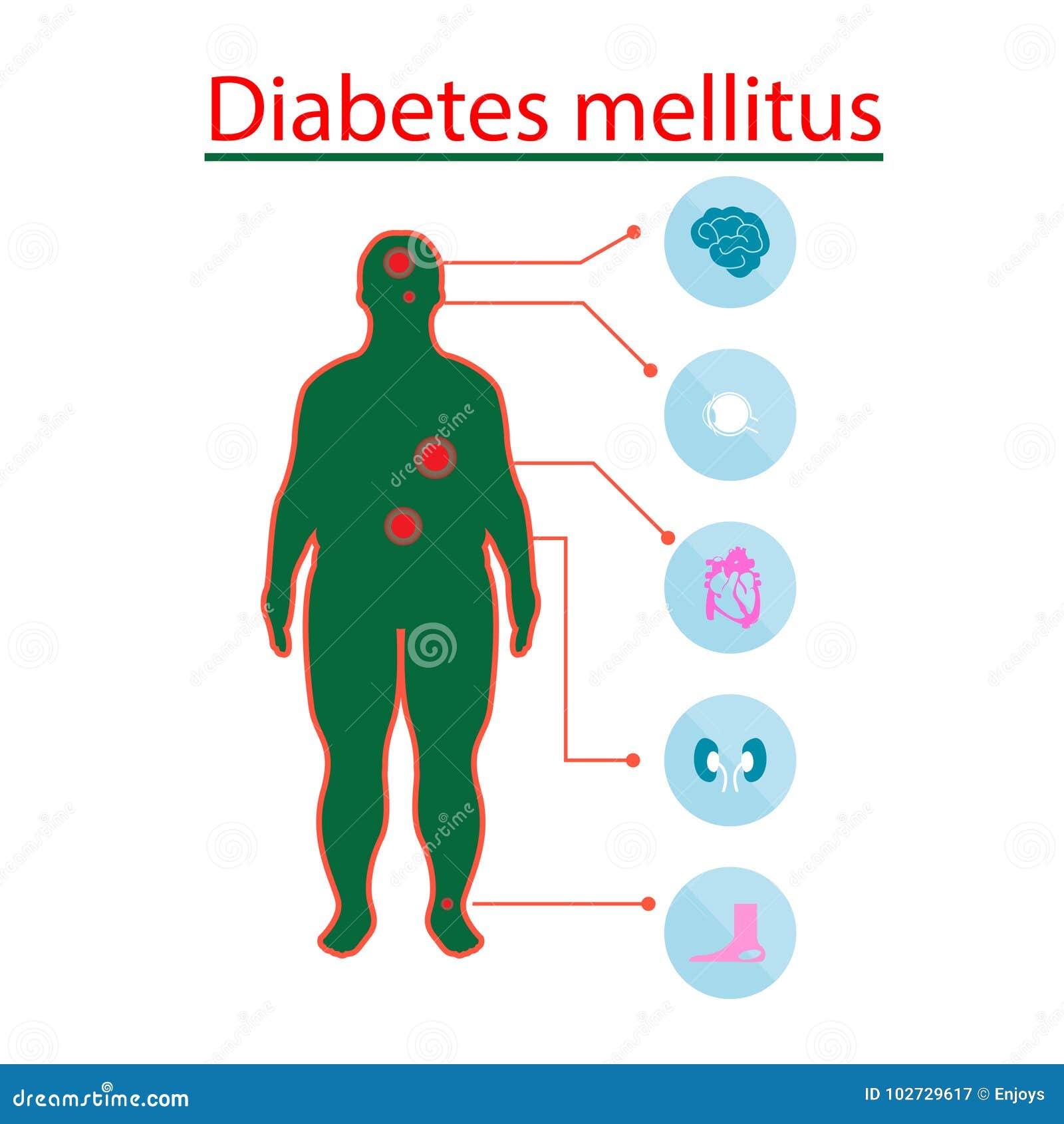 Complications of Diabetes Mellitus in Fat People. Illustration in ... Complications of Diabetes Mellitus in Fat People. Illustration in ...