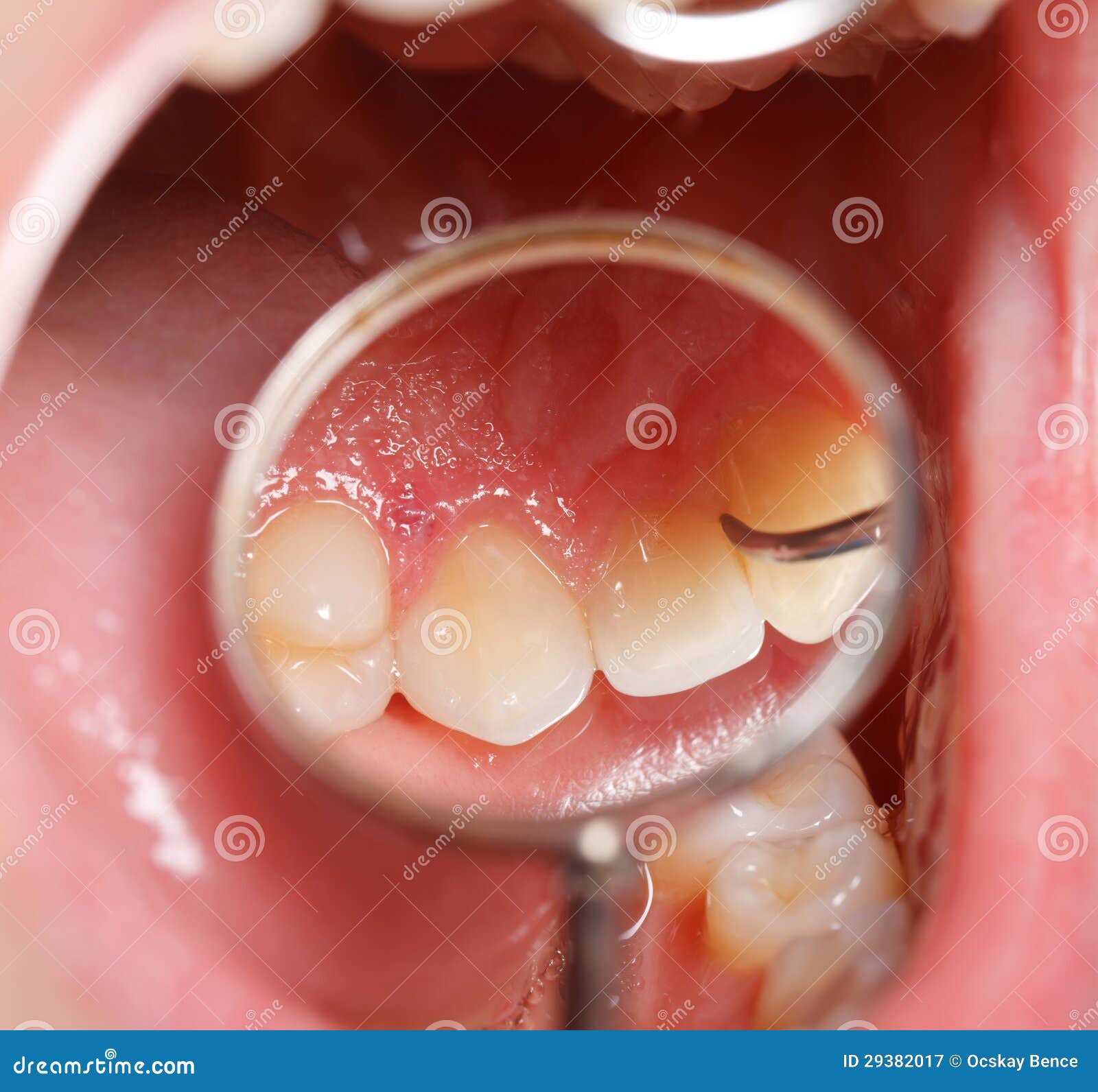 Comprehensive Dental Examination Stock Image - Image of consultation ...