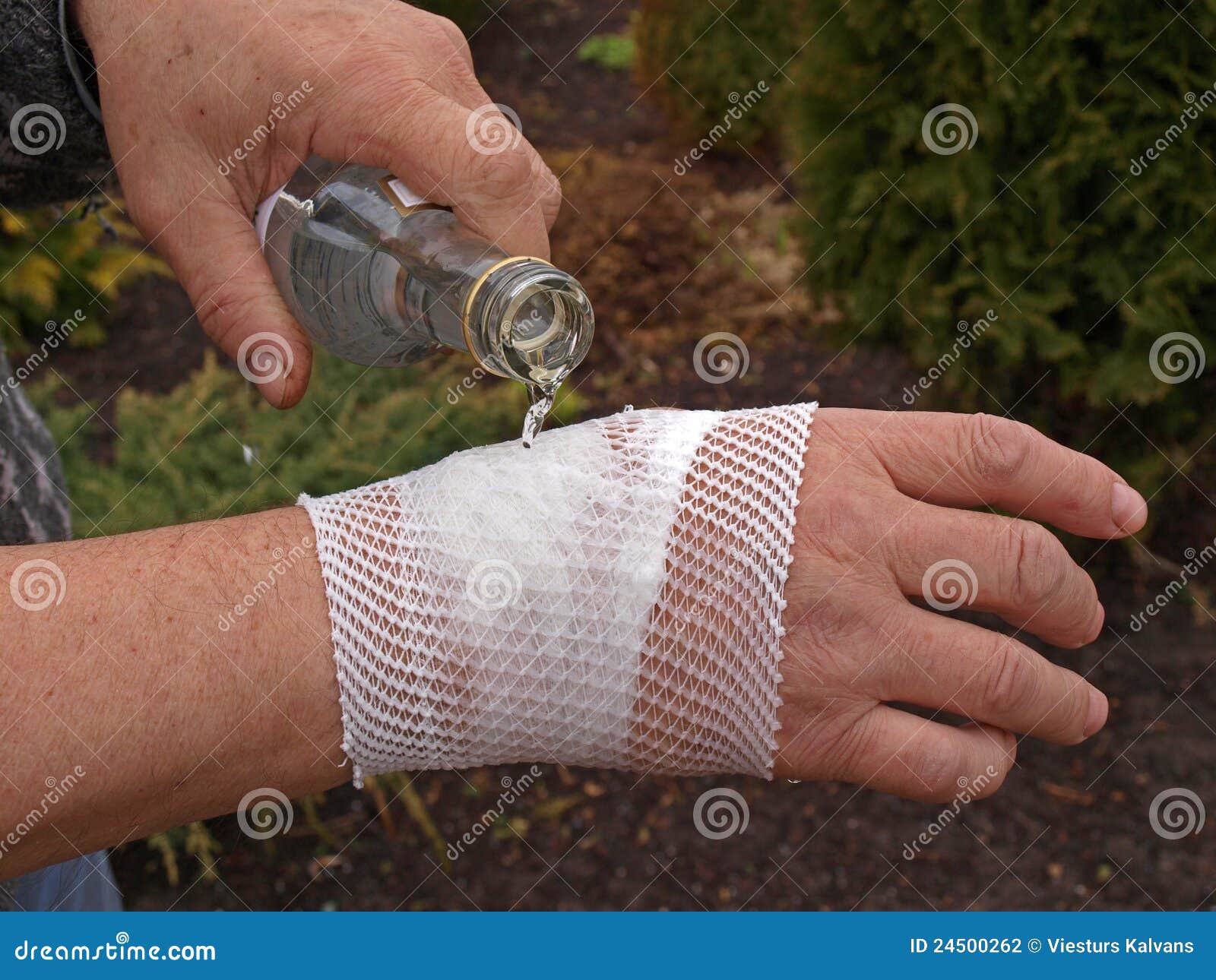 Compresa del alcohol foto de archivo. Imagen de humano - 24500262