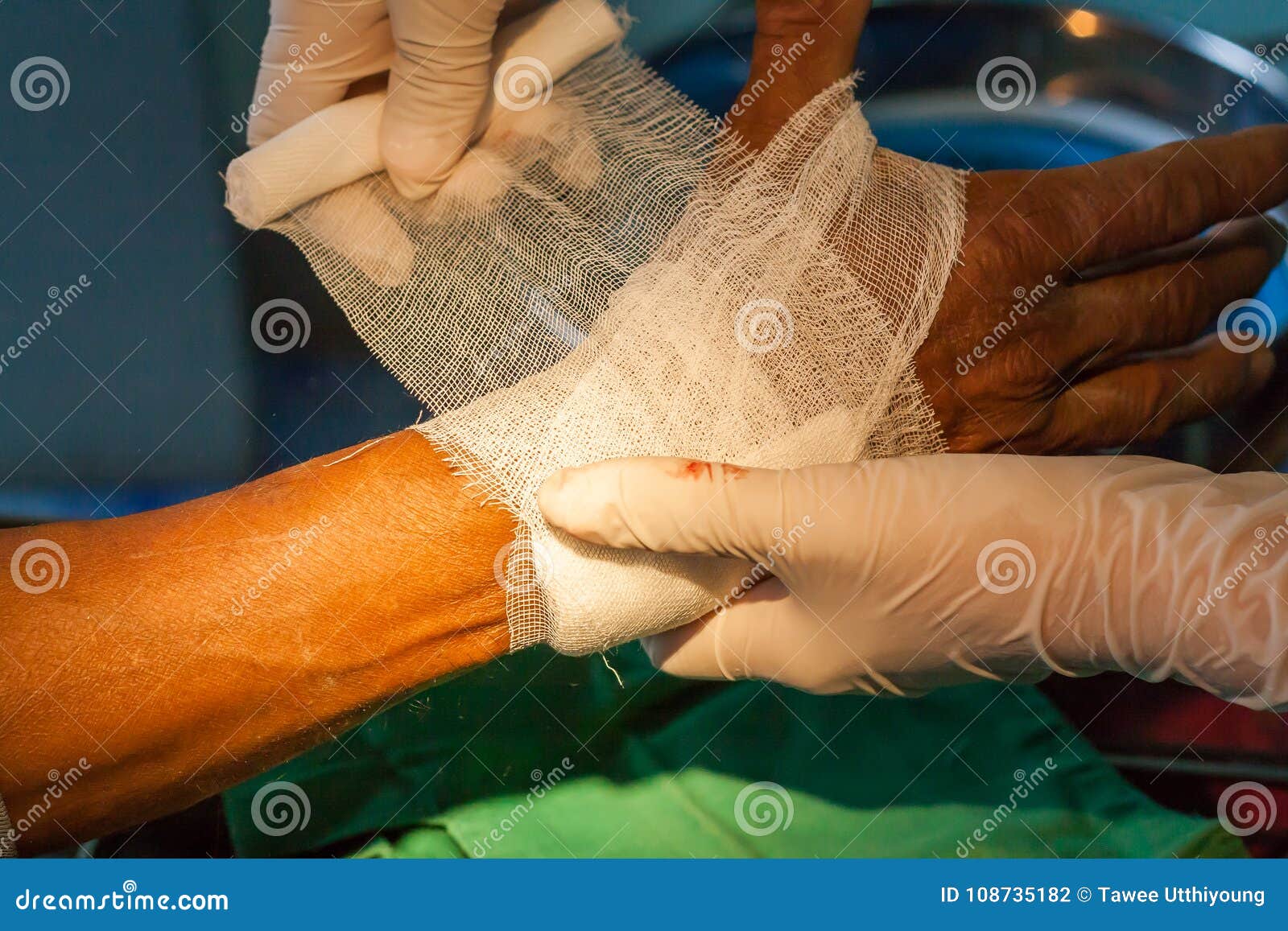 724 Compression Wound Photos - Free & Royalty-Free Stock Photos from ...
