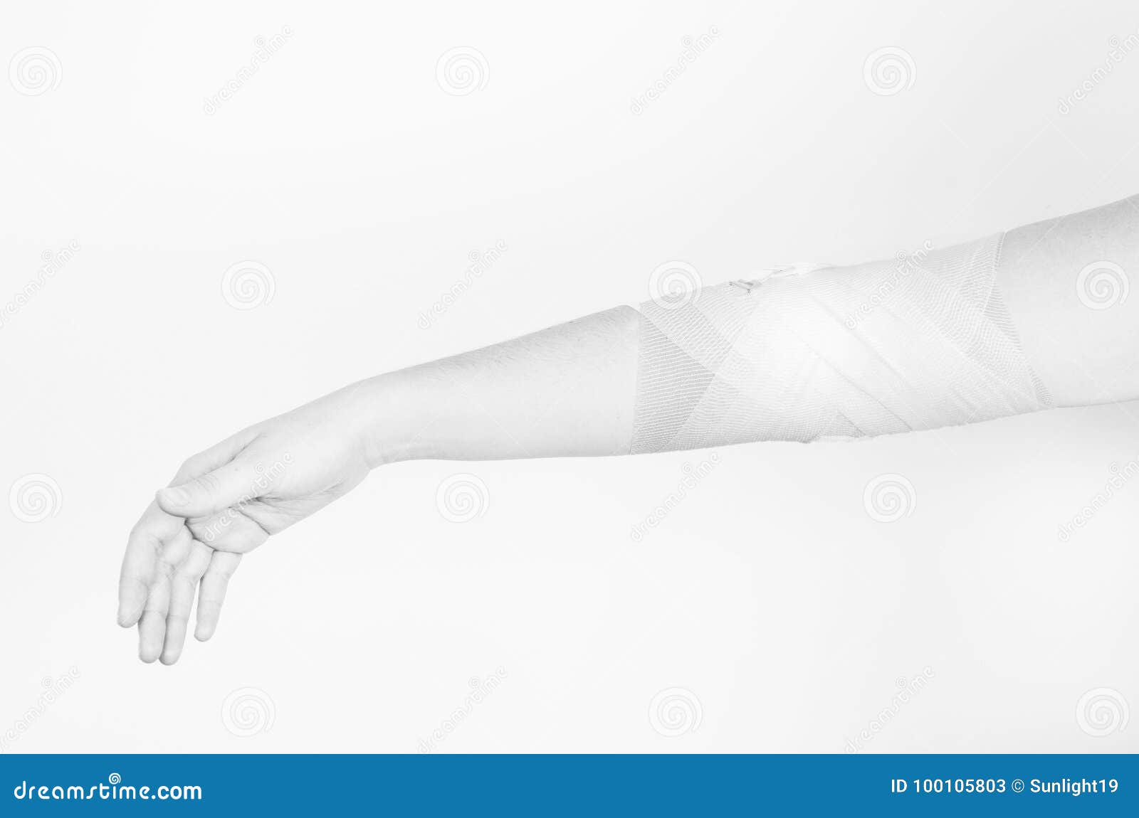 Compression Bandage To Inflammation, Application of Figure of Eight ...