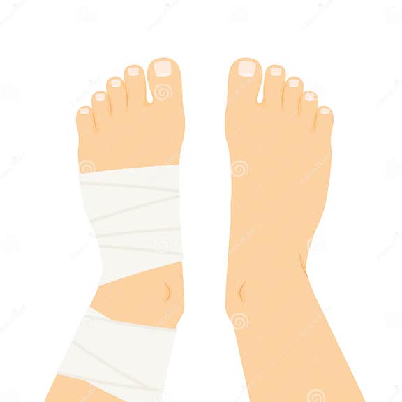 Compression Bandage Wrapped Around the Twisted Ankle Stock Illustration ...