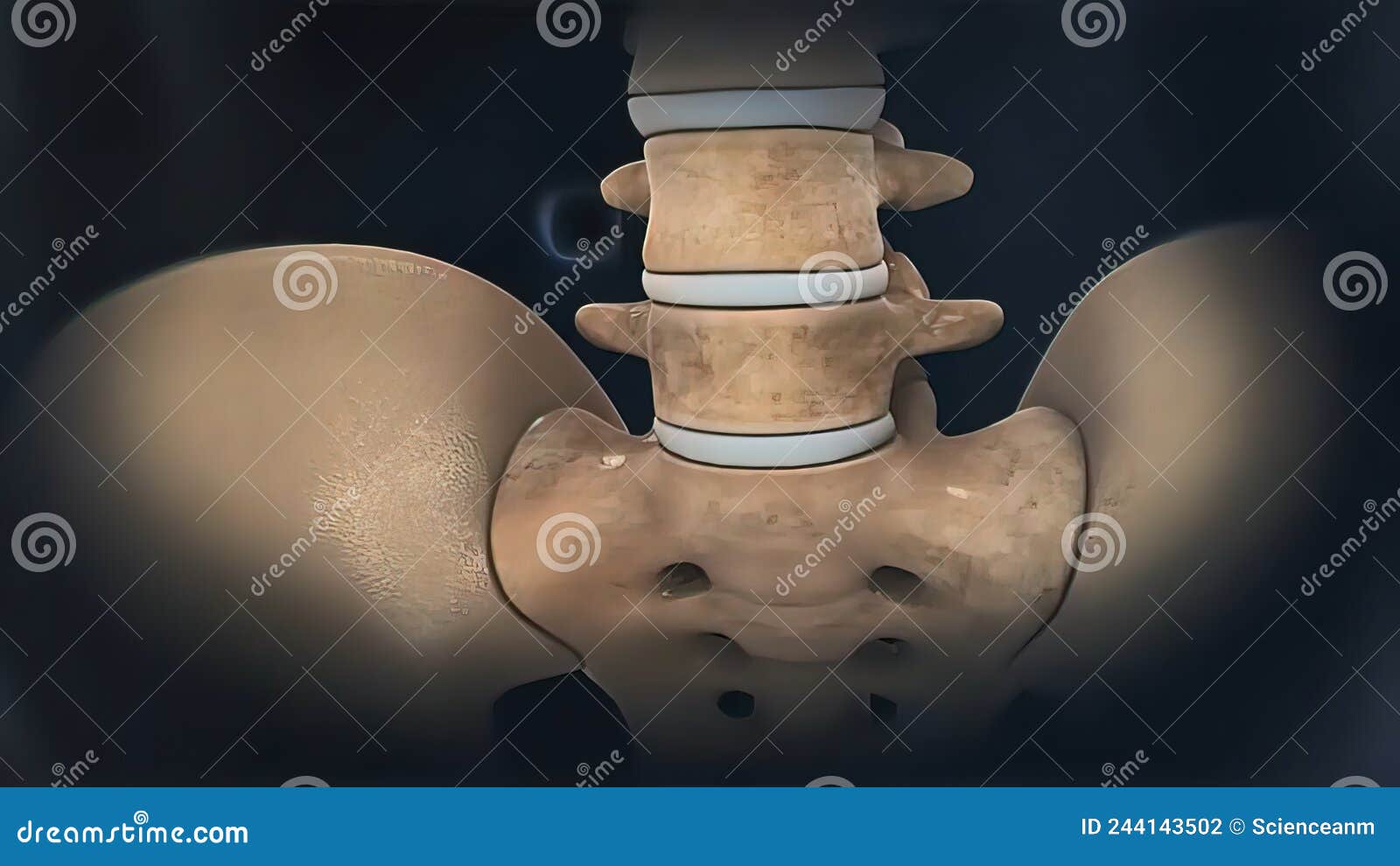 Compression of the Disc Arthritis Effects on the Spine Stock ...