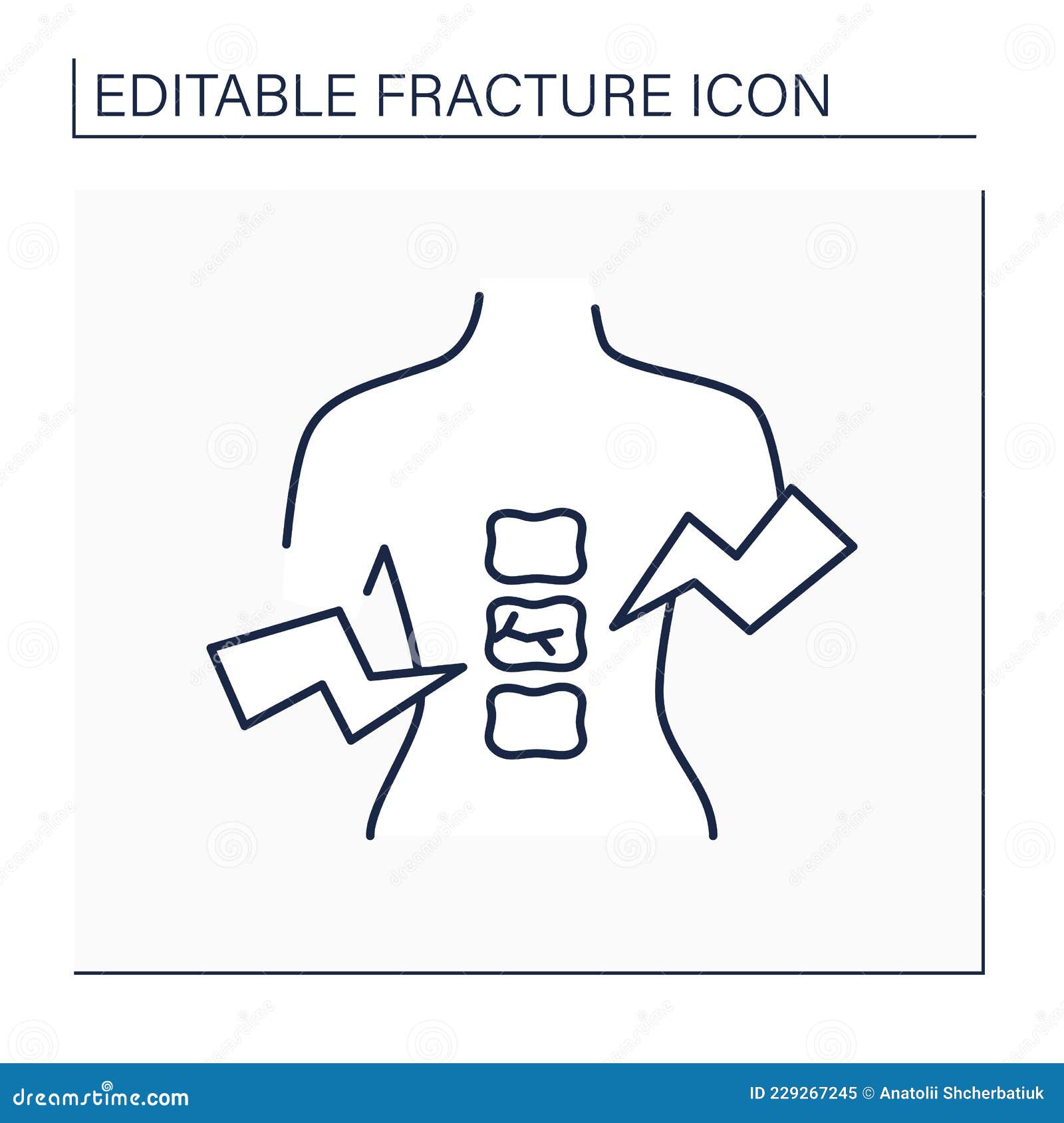 Compression Fracture Of The Spine Cartoon Vector