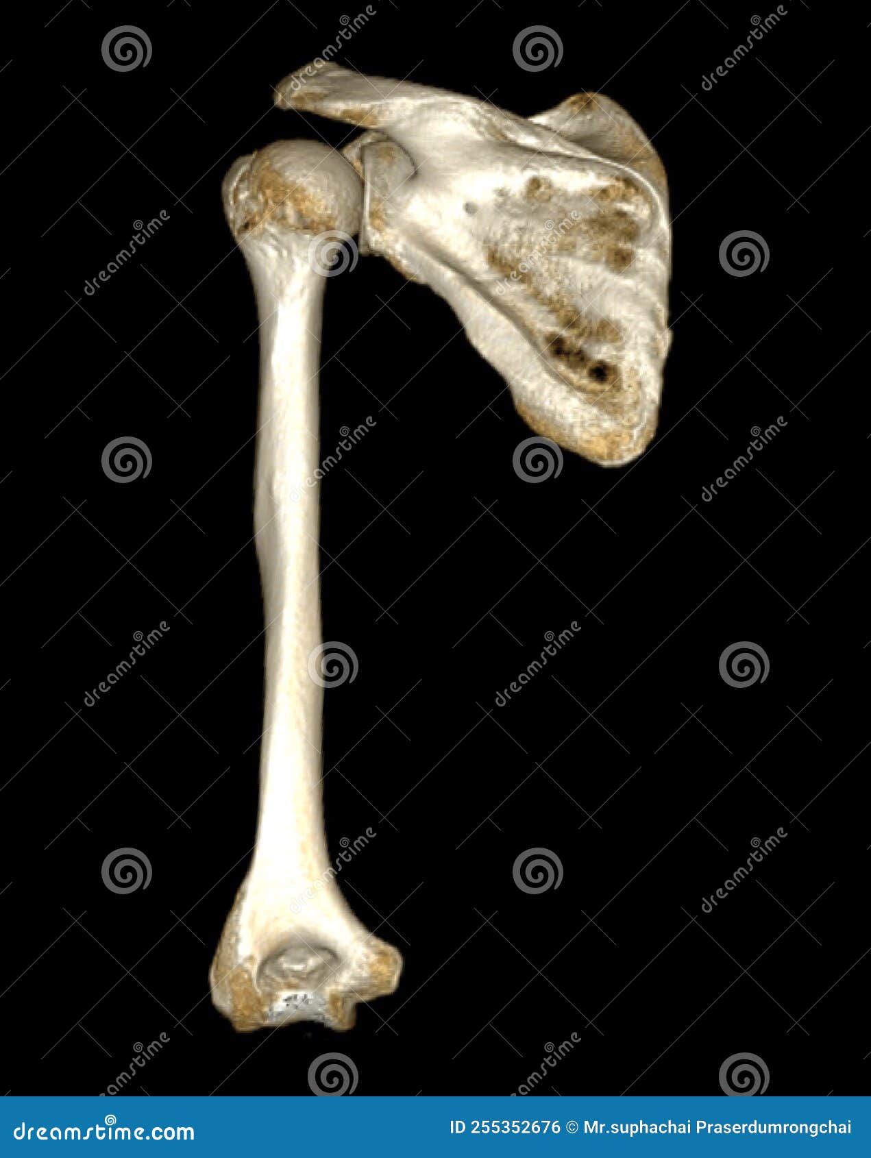 CT Scan of Shoulder Joint and Humerus Bone or Arm Stock Illustration ...