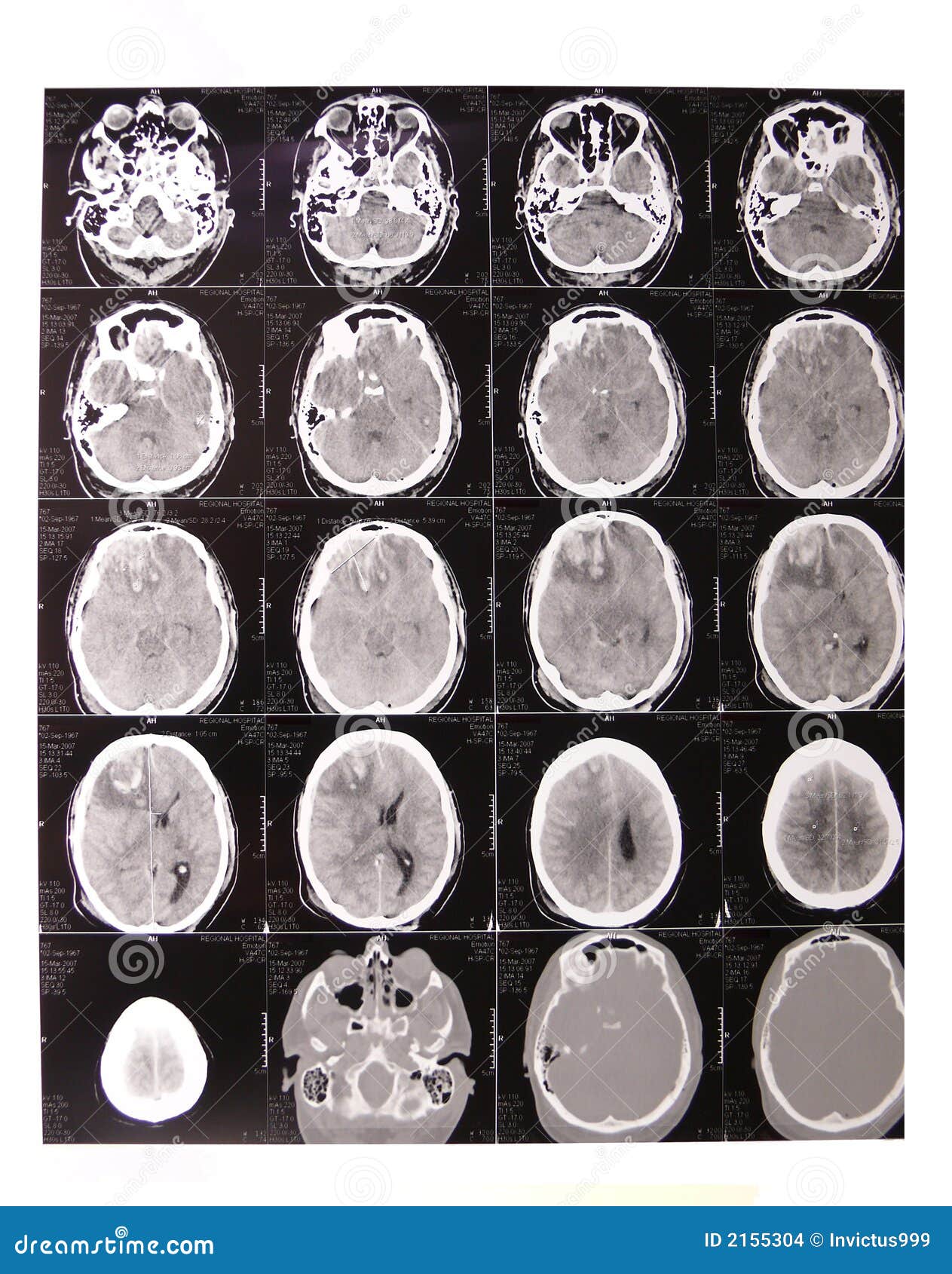 Computer Aided Tomography stock photo. Image of equipment - 2155304