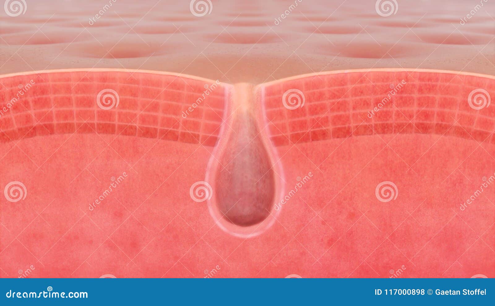 Skin Pore Enlarge, Beauty Procedure Line And Silhouette Black Icon Set ...