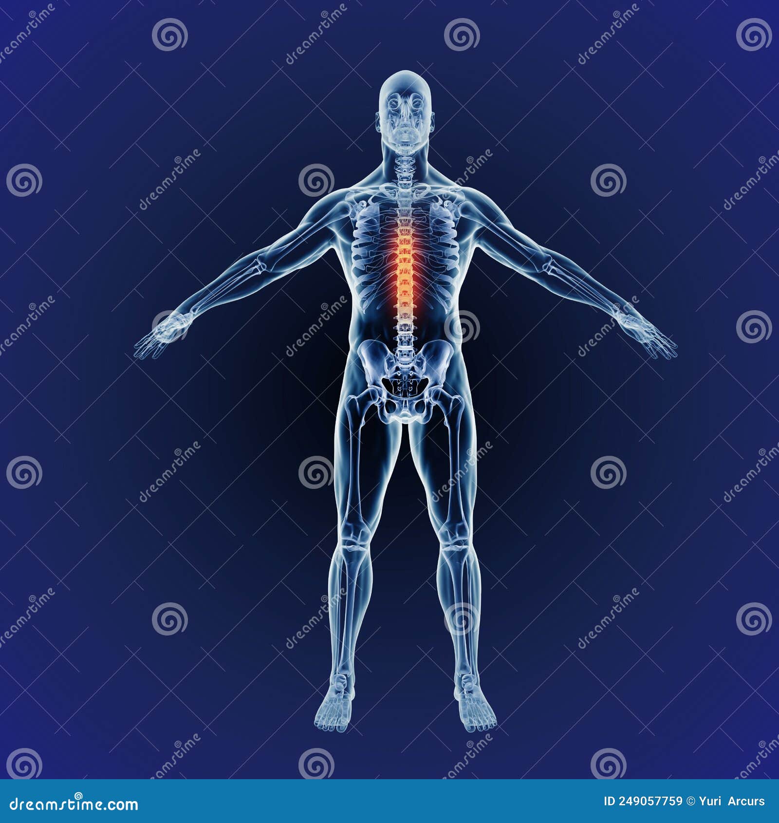 Upper Back Pains. when Inflammation Strikes. Computer Generated ...