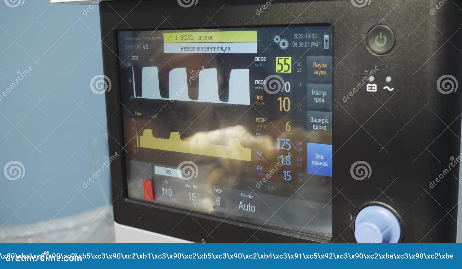 Computer Monitor of the Artificial Lung Ventilation Apparatus. the ...