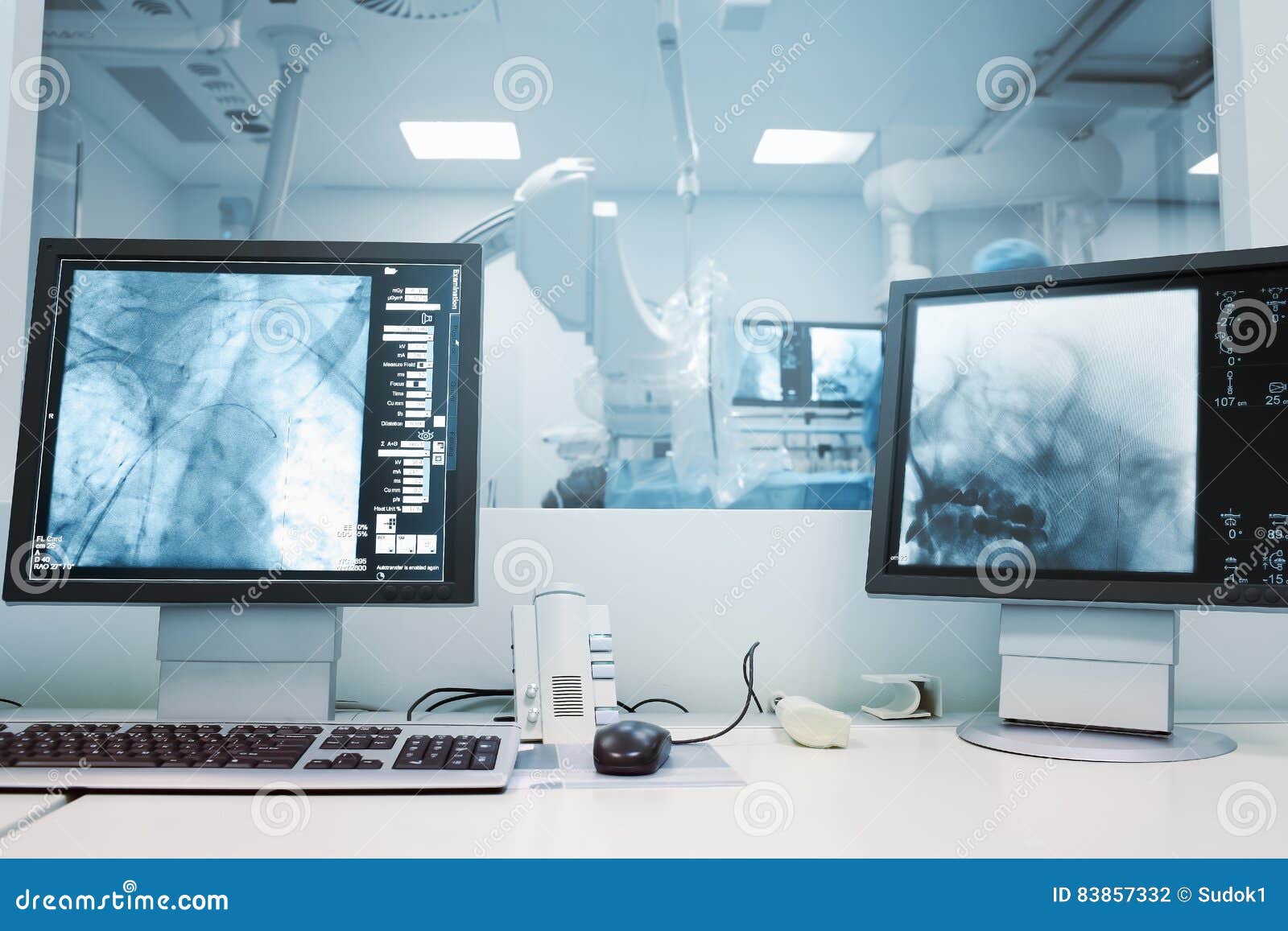 Computer Monitoring of Brain Operation Stock Photo - Image of clinic ...