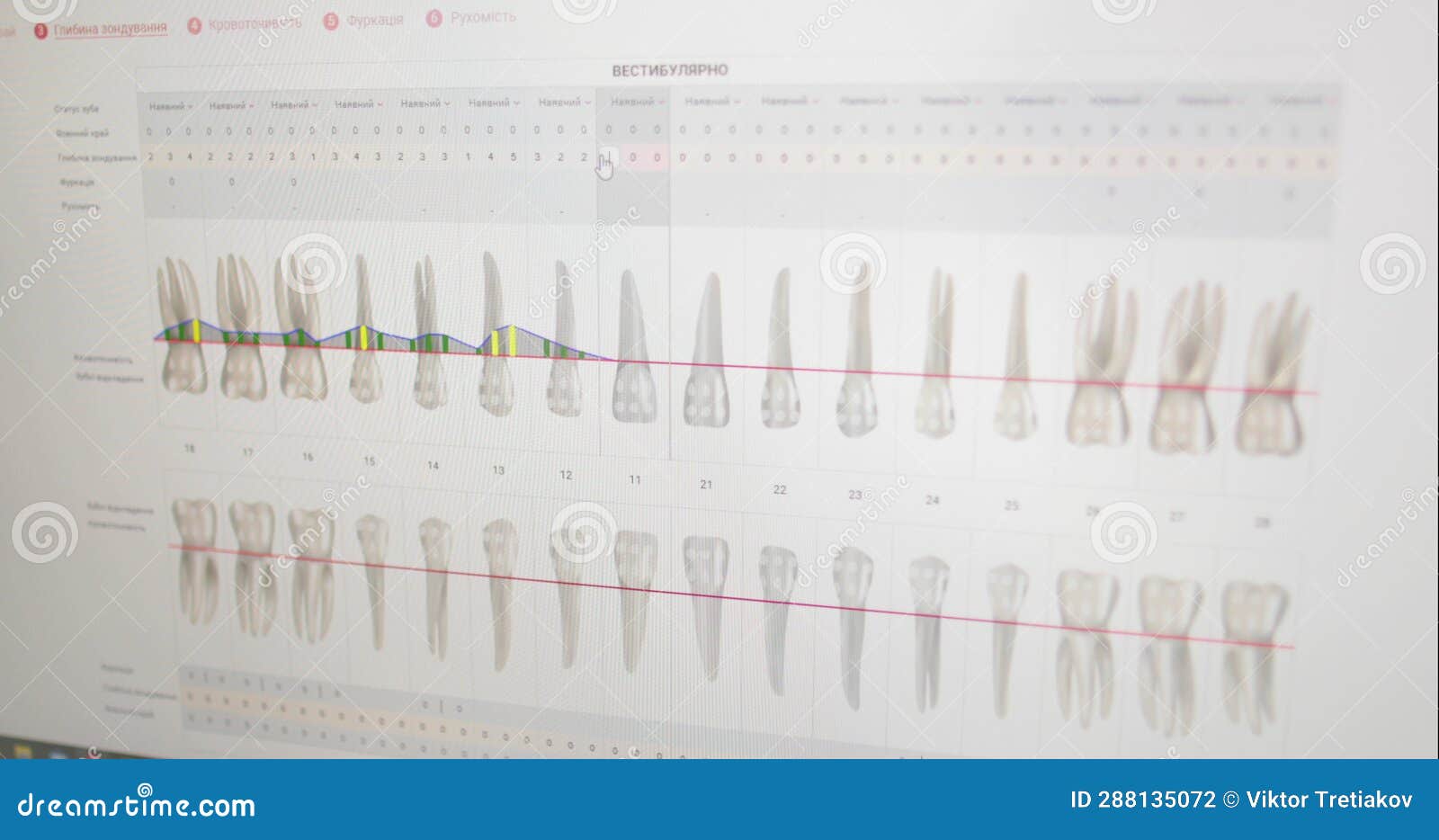 Computer Monitors in the Oral Care Clinic. Stock Photo - Image of ...