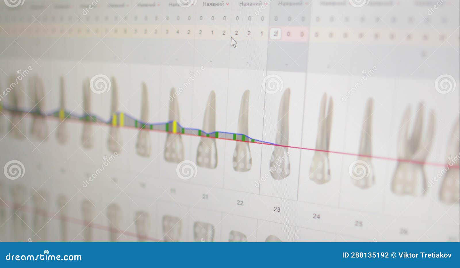 Computer Monitors in the Oral Care Clinic. Stock Photo - Image of oral ...