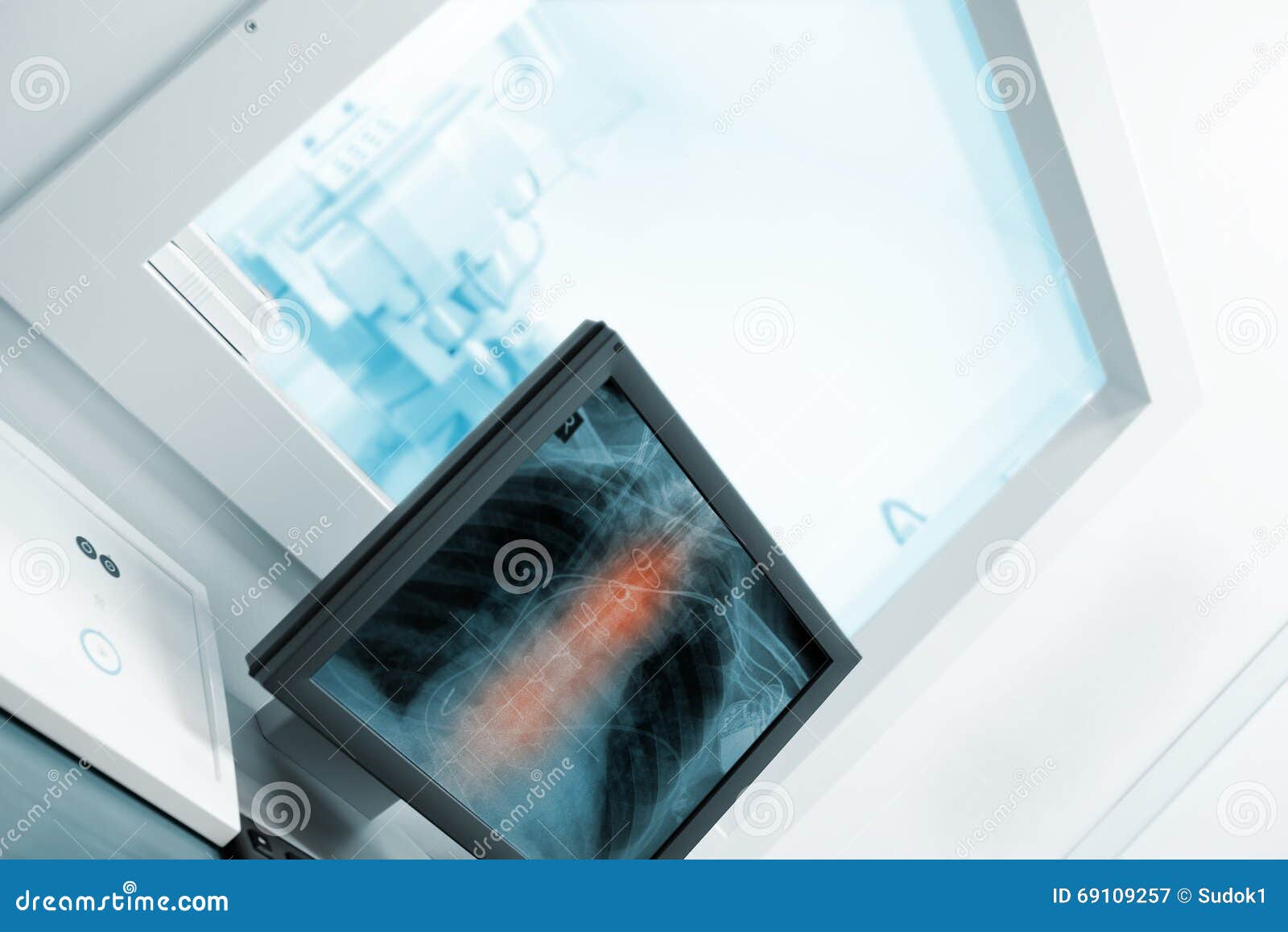Computer in the X-ray Cabinet Stock Image - Image of healthcare ...