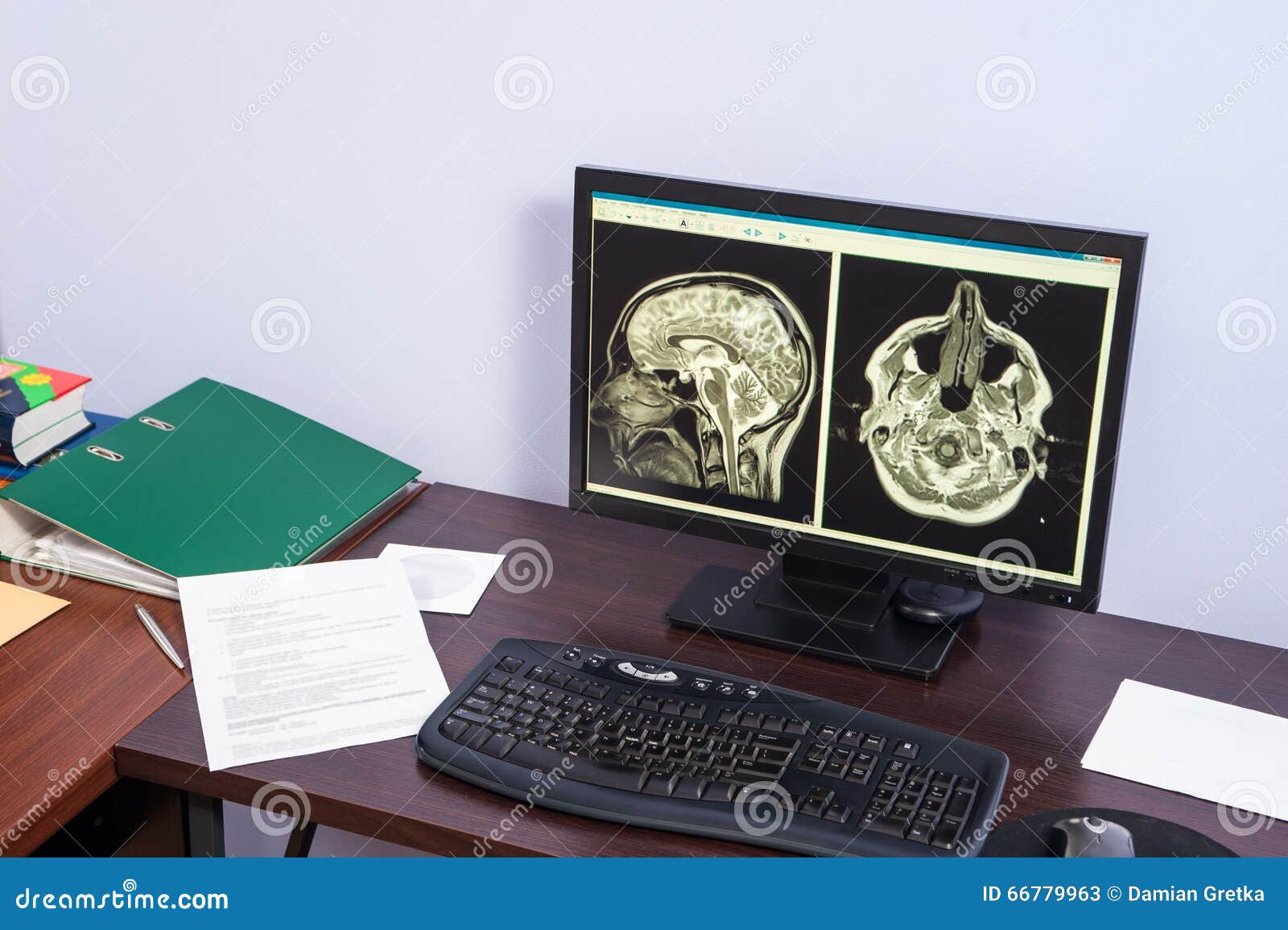 Computer Tomography / Computed Tomography Stock Image - Image of office ...