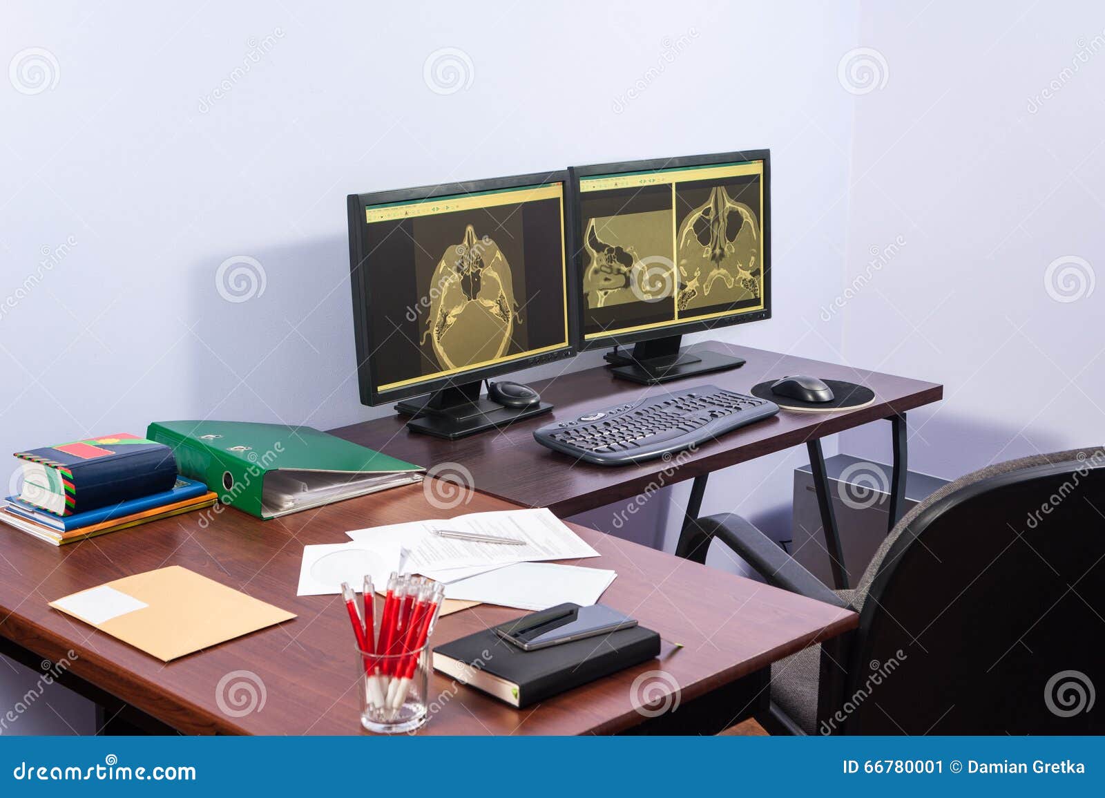 Computer Tomography / Computed Tomography Stock Image - Image of ...