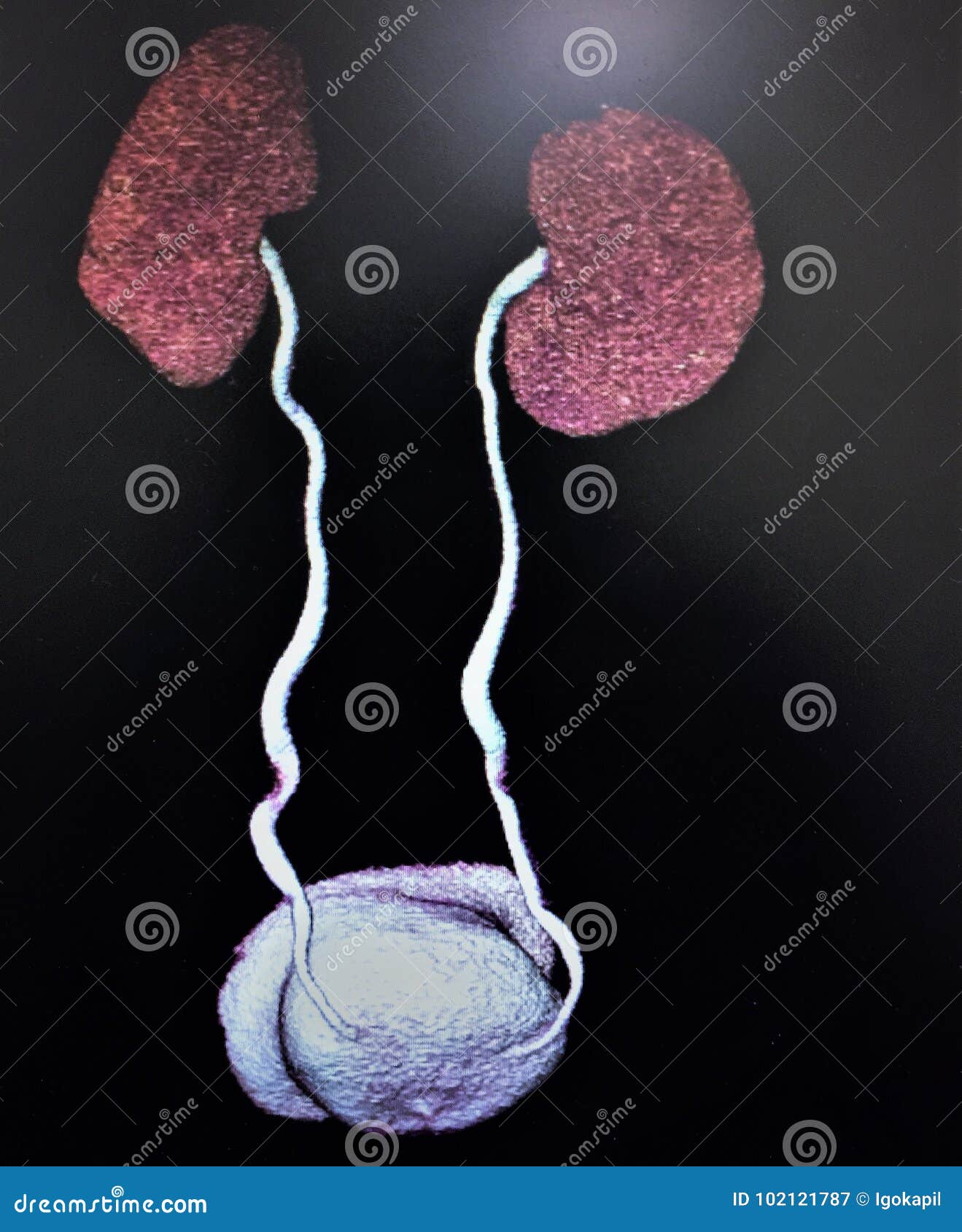 Computer Tomography 3d Imaging Urology Stock Image - Image of ...