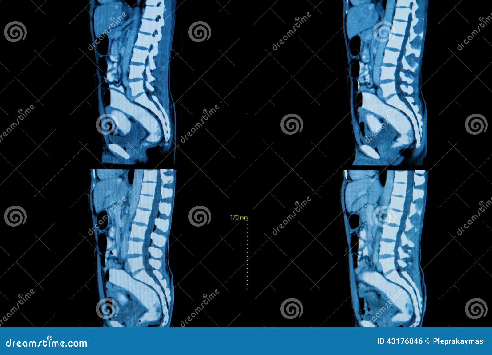 Computer Tomography of Human Body Stock Photo - Image of healthcare ...