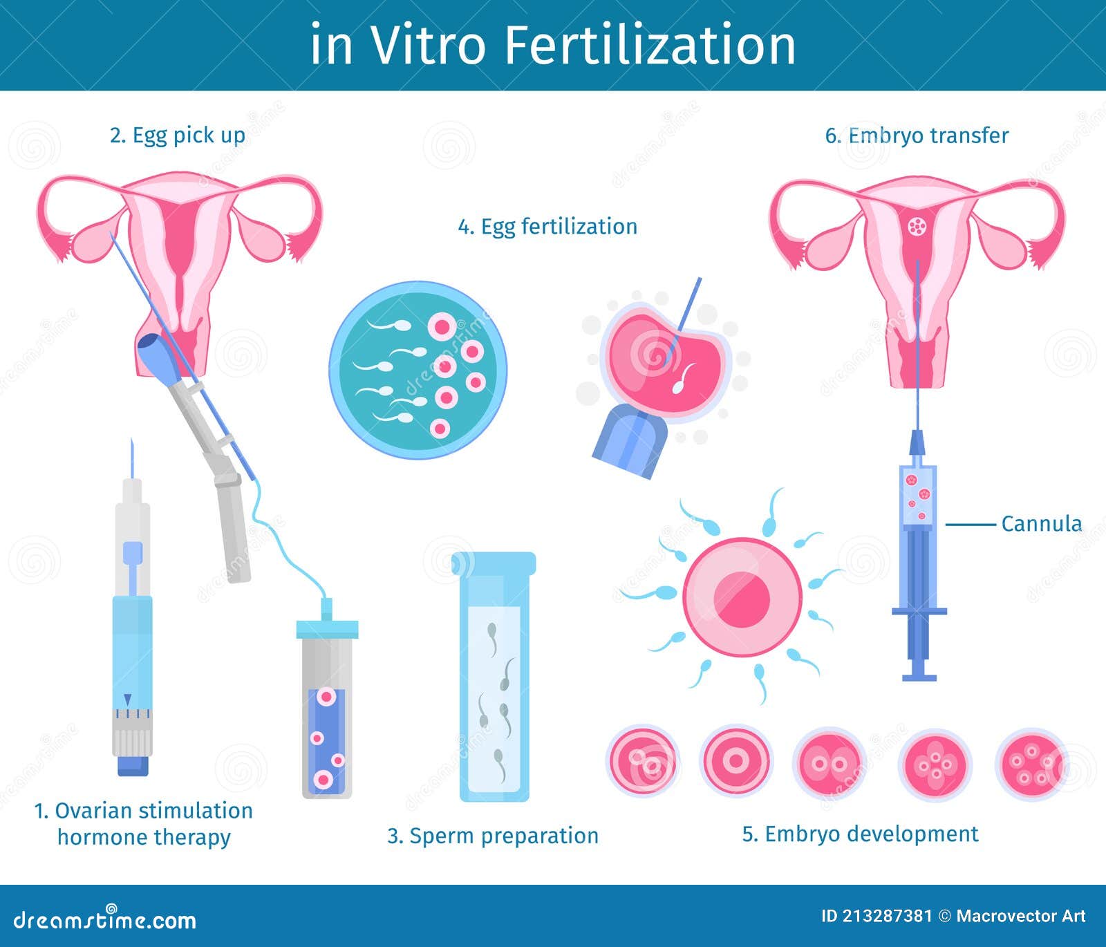 Conceito De Processo De Fertilização In Vitro Ilustração Do Vetor