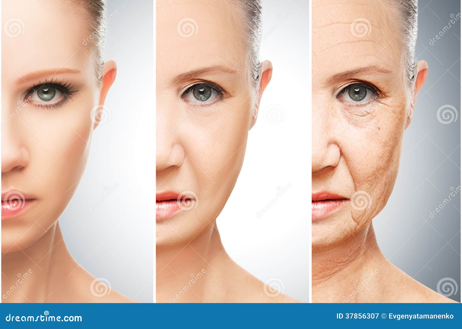 Aging Skin Folds Or Skin Creases Or Wrinkles At Neck Of Asian, Chinese ...
